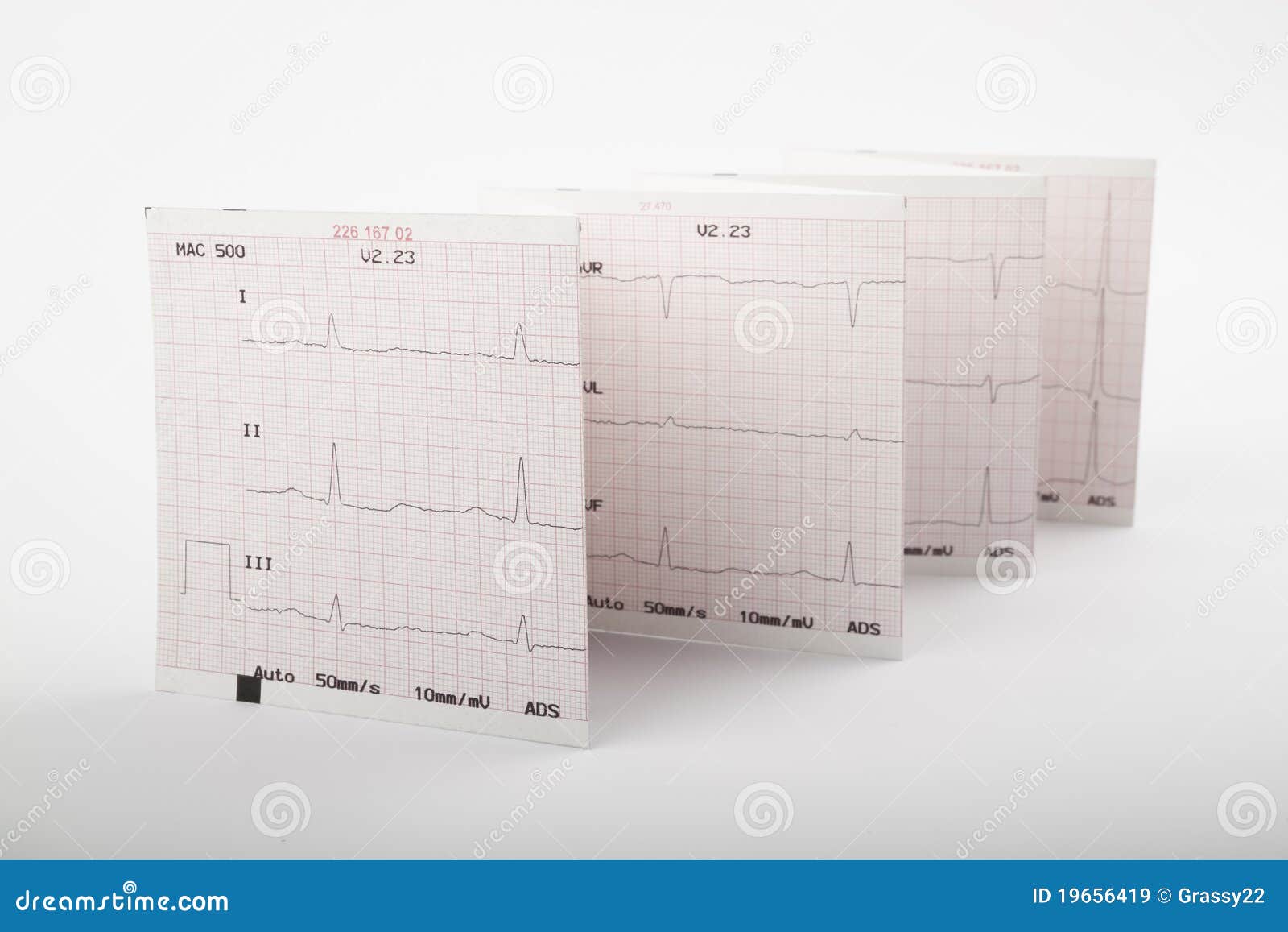 Cardiogramme image stock. Image du configuration, papier - 19656419