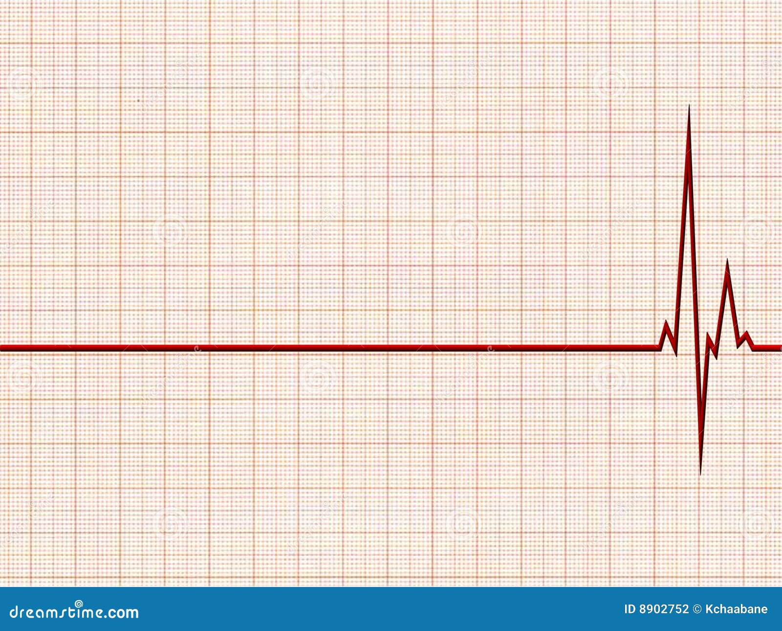 Cardiogramme illustration stock. Illustration du électrocardiogramme ...