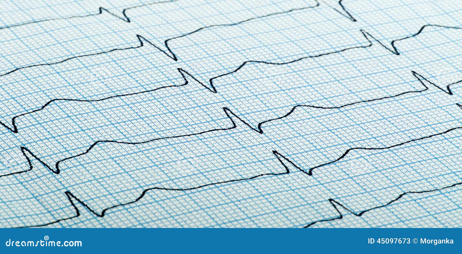 Cardiogramme De Battement De Coeur Image stock - Image du soin, grille ...