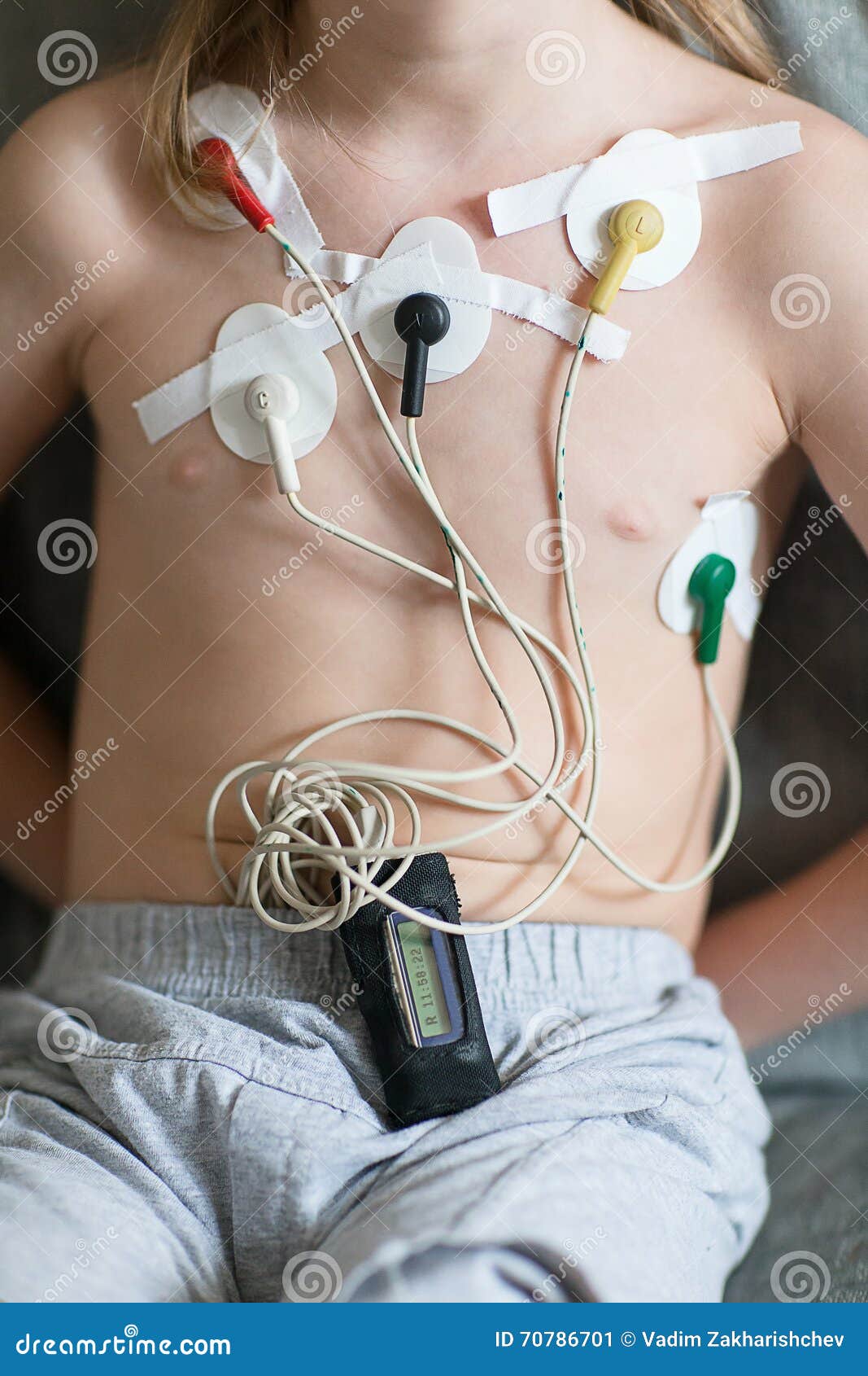 Cardiogramme De Coeur Utilisant Holter Image stock - Image du ...