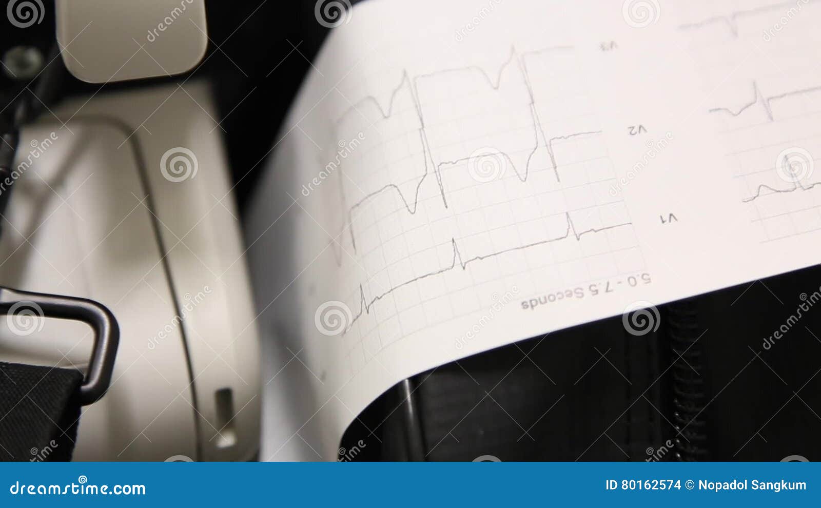 Cardiograph Stock Footage & Videos - 243 Stock Videos