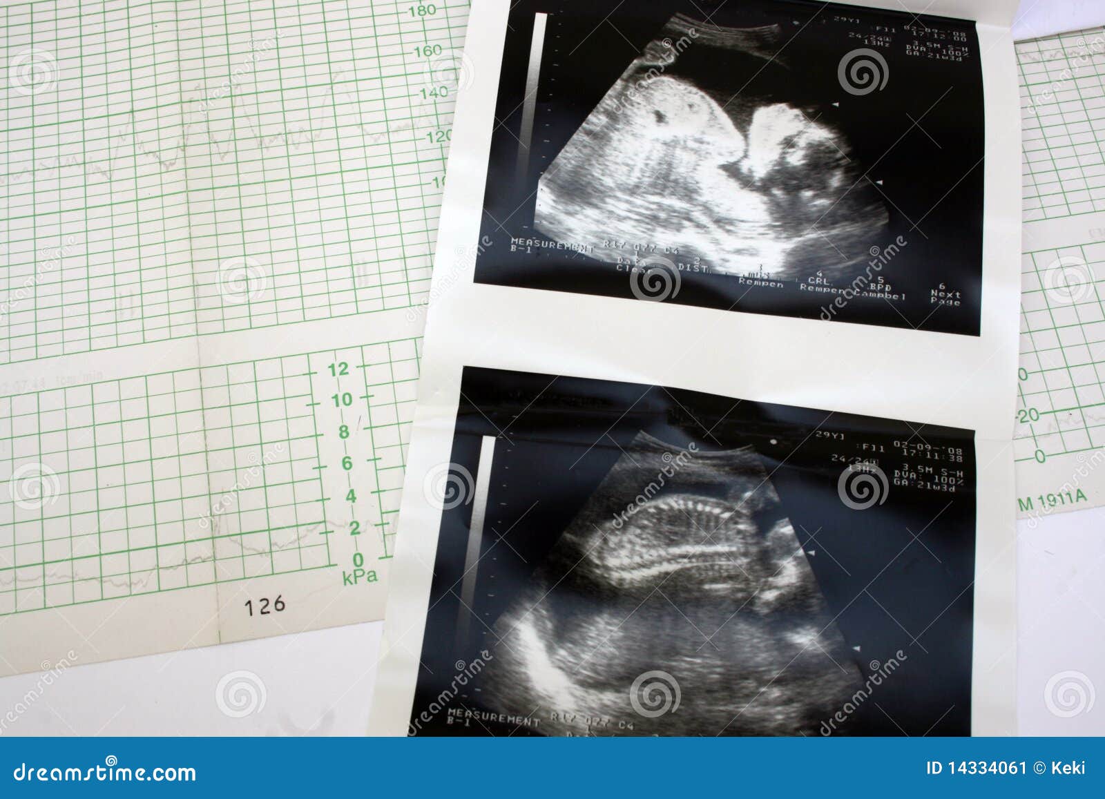 Cardiograph and ultrasound stock image. Image of monitor - 14334061
