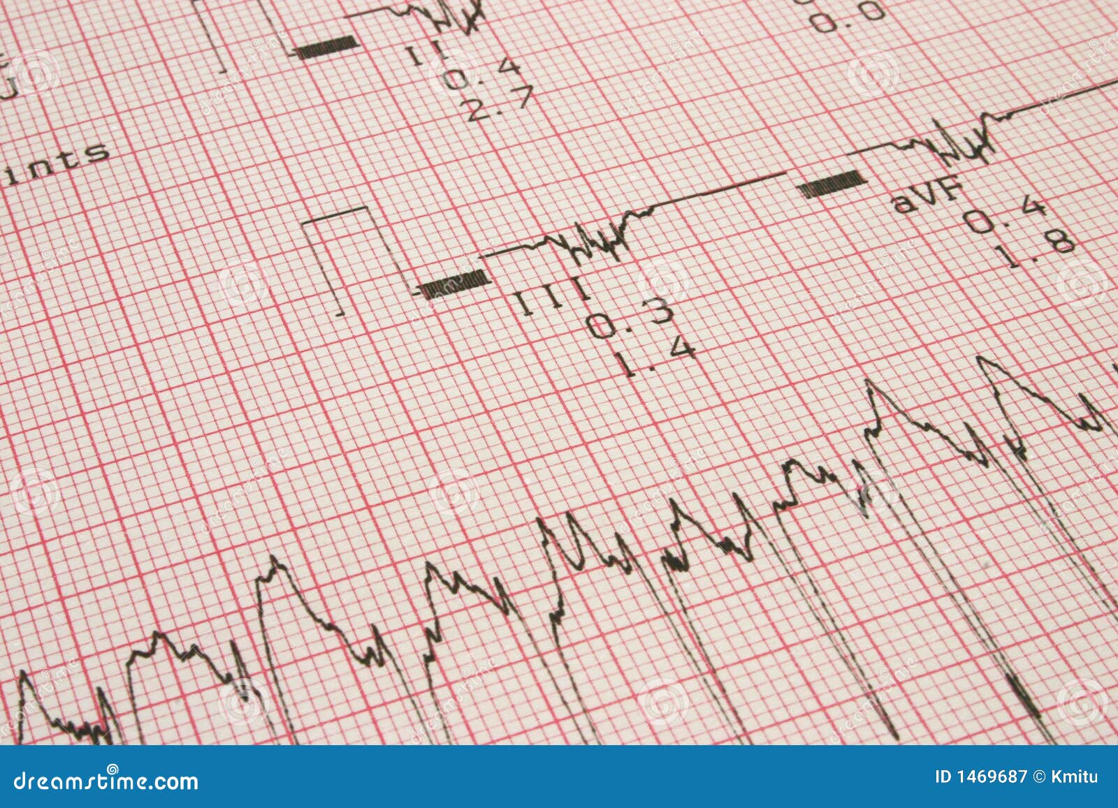 Cardiological test results stock image. Image of cardiograph - 1469687