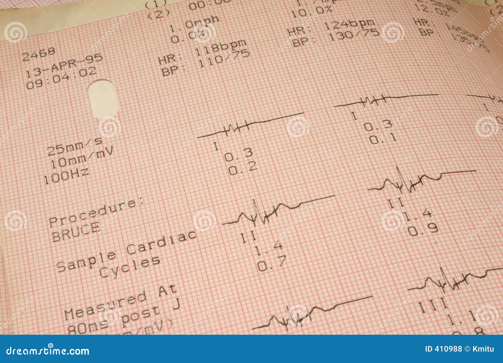 Cardiological test results stock photo. Image of analyze - 410988