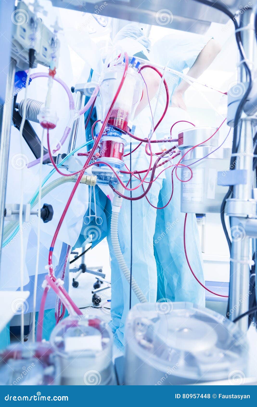 Cardiopulmonary Bypass Blood Container Stock Photo | CartoonDealer.com ...