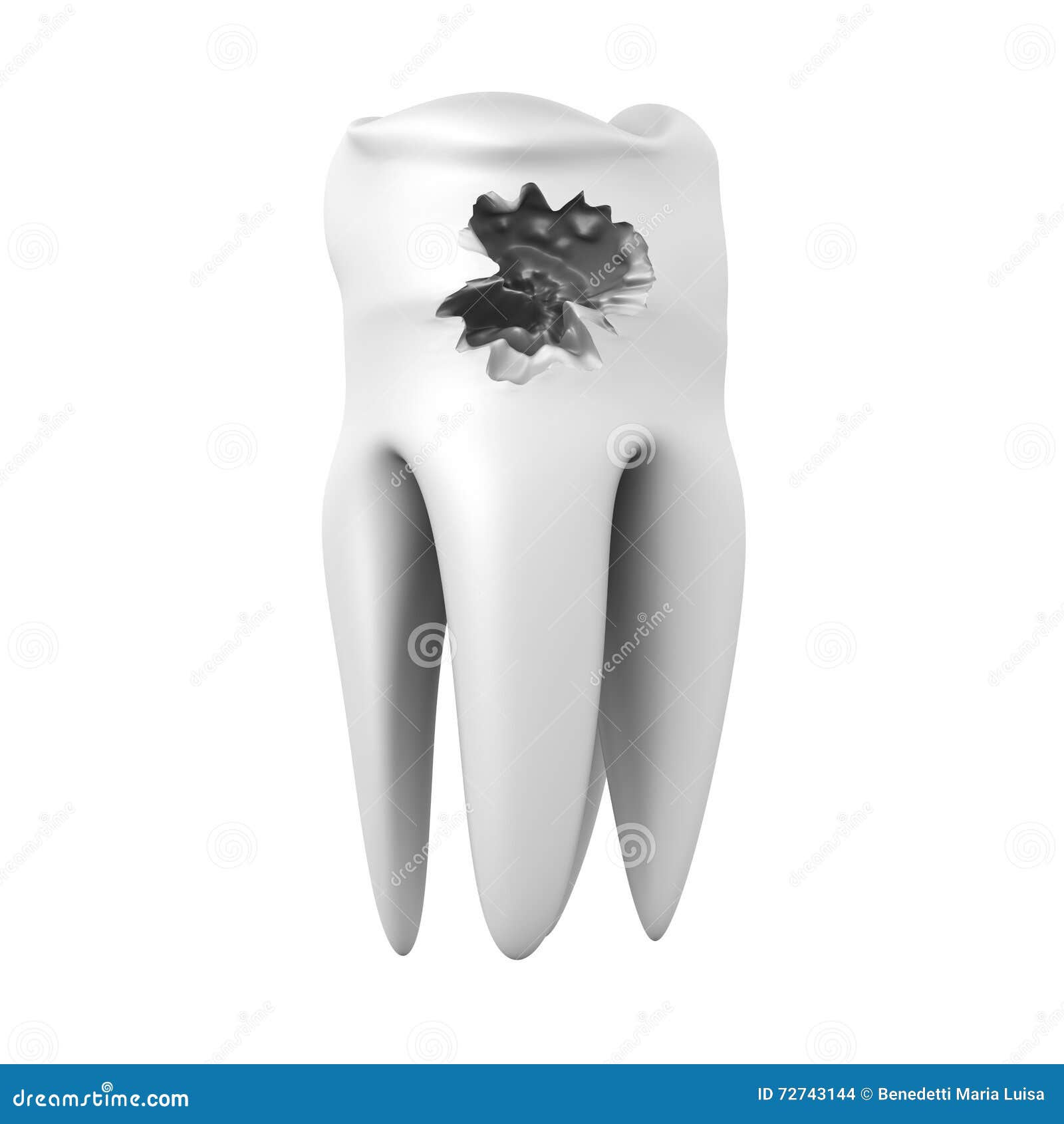 Caries stock illustration. Illustration of isolated, health - 72743144