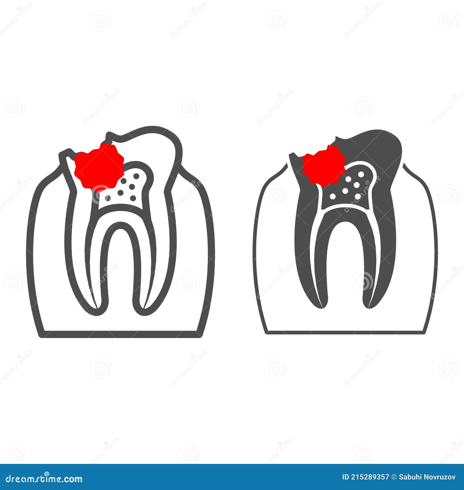 Caries Line and Solid Icon, Human Diseases Concept, Inflammation of ...