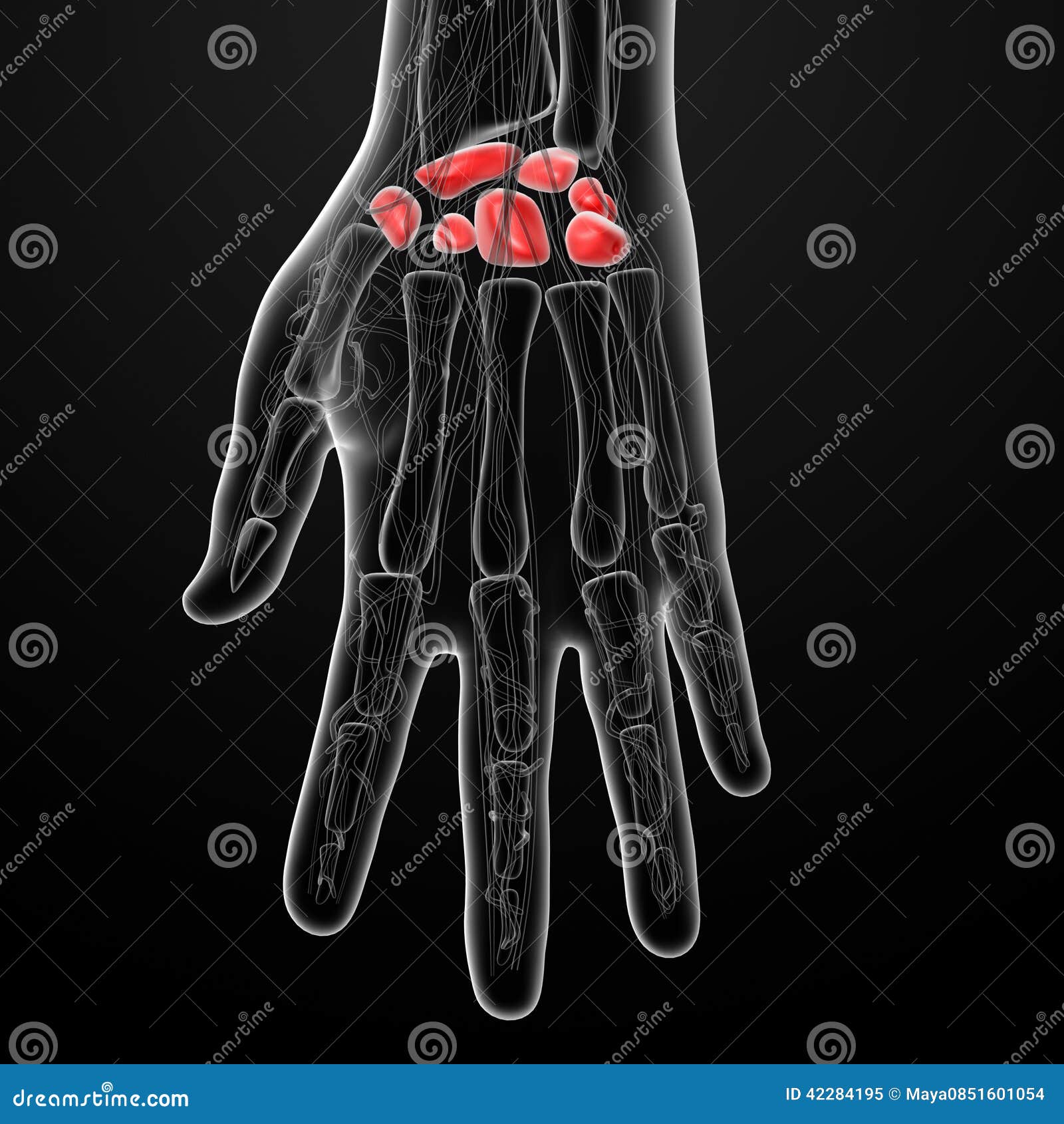 Carpal Bones. X-ray Blue Realistic Palm On Dark Background Cartoon ...