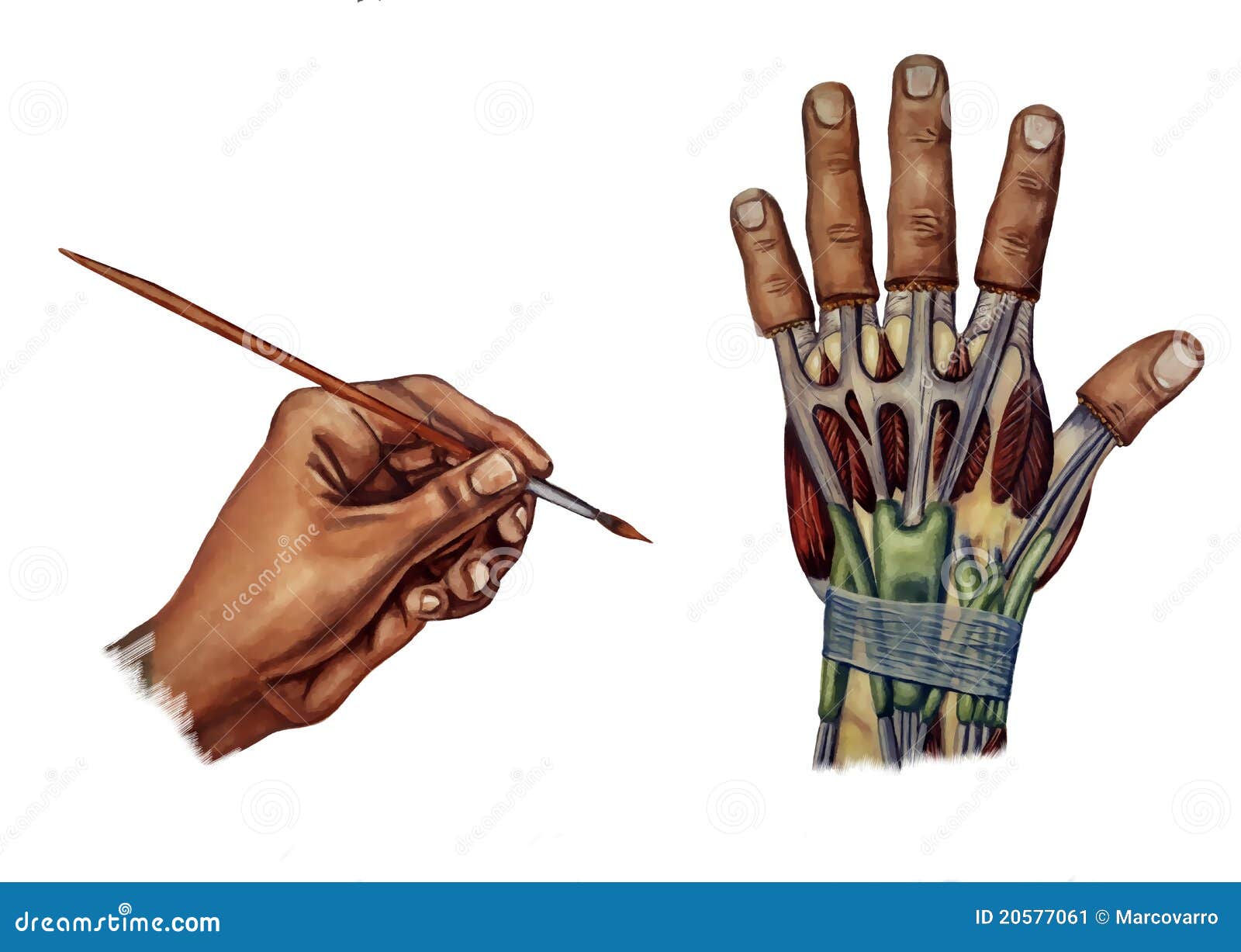 Carpal Tunnel Syndrome Concept Icon Cartoon Vector | CartoonDealer.com ...
