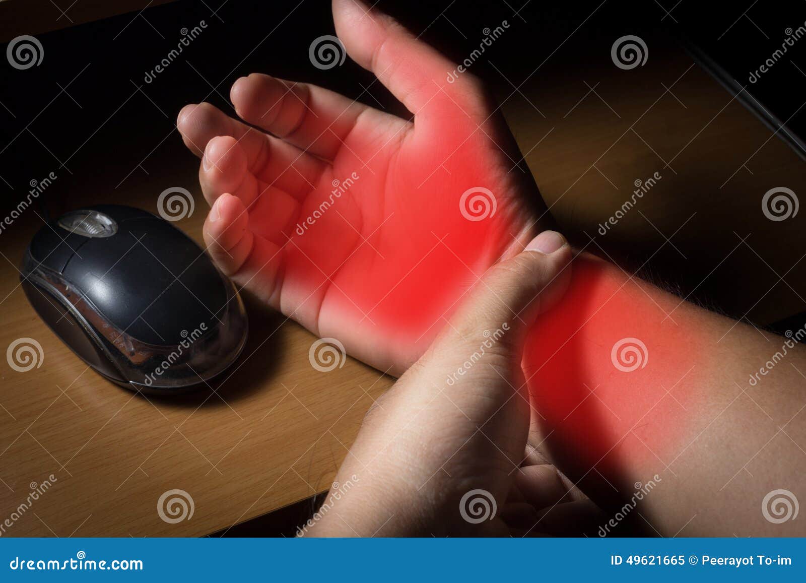 Carpal Tunnel Syndrome. Hand Pain In Woman Injury Wrist. Arthritis ...