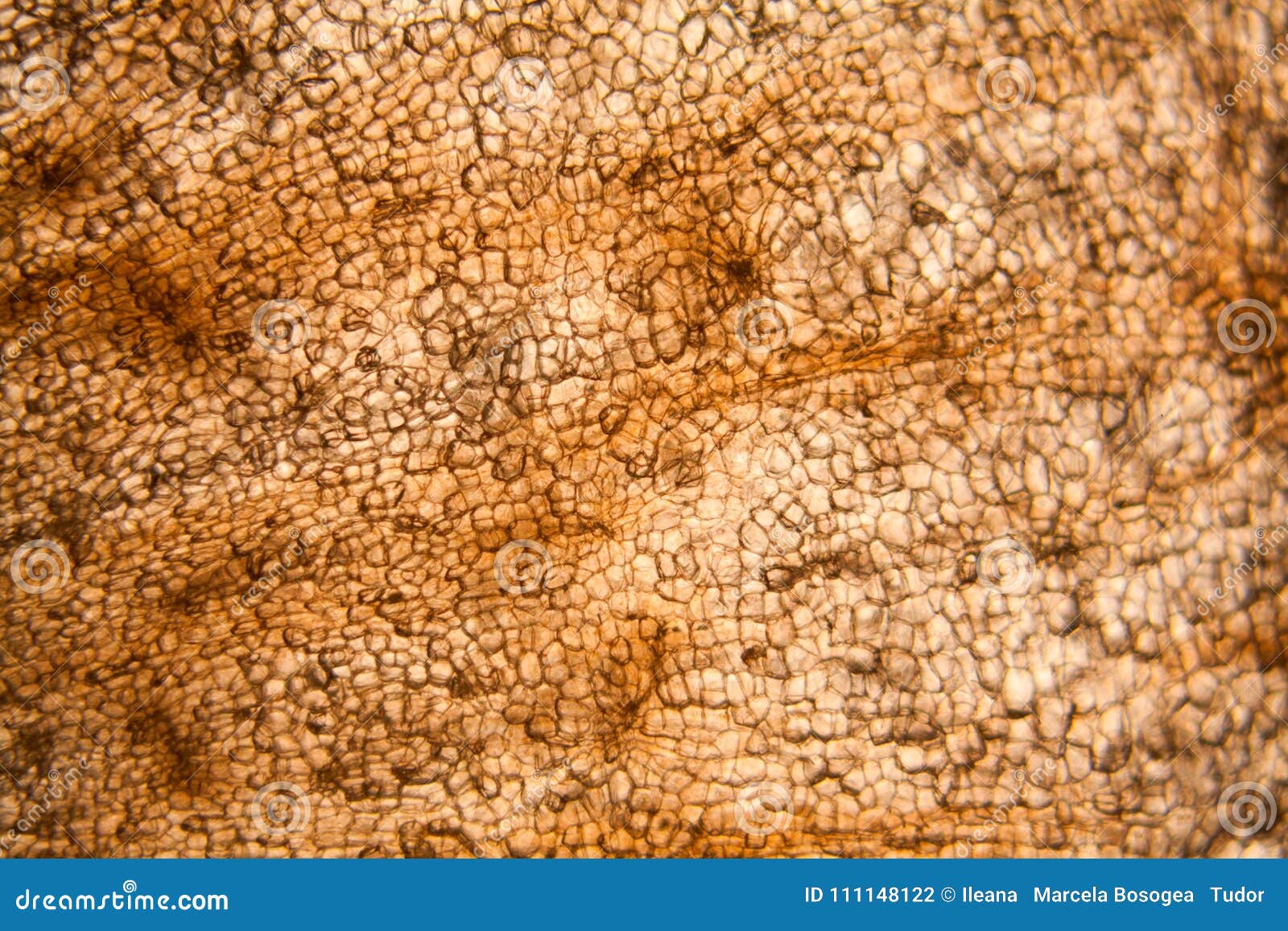 Carrot Cells at the Microscope Stock Photo - Image of microscopic ...