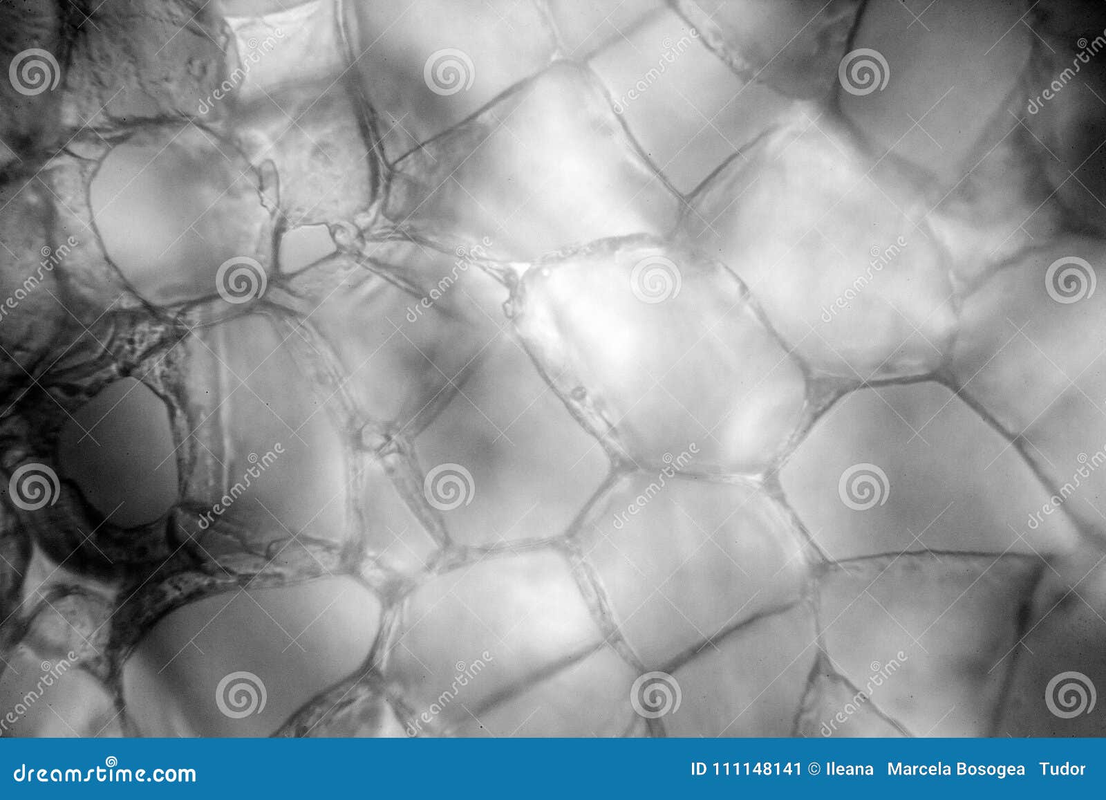 Carrot Cells at the Microscope Stock Image - Image of daucus, plant ...