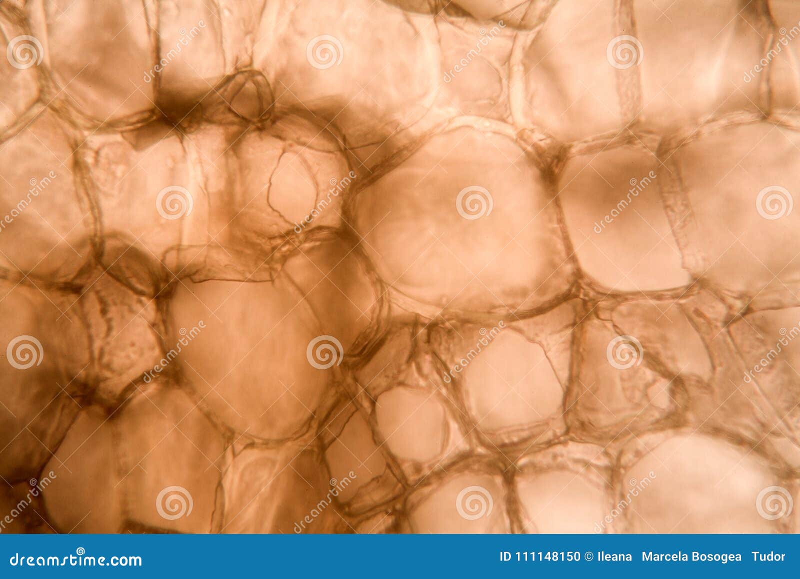 Carrot Cells at the Microscope Stock Photo - Image of natural, carrot ...