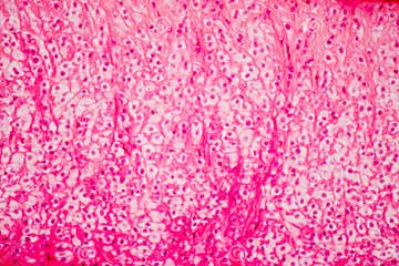 Cartilage Cells Under the Microscope Stock Image - Image of cartilage ...