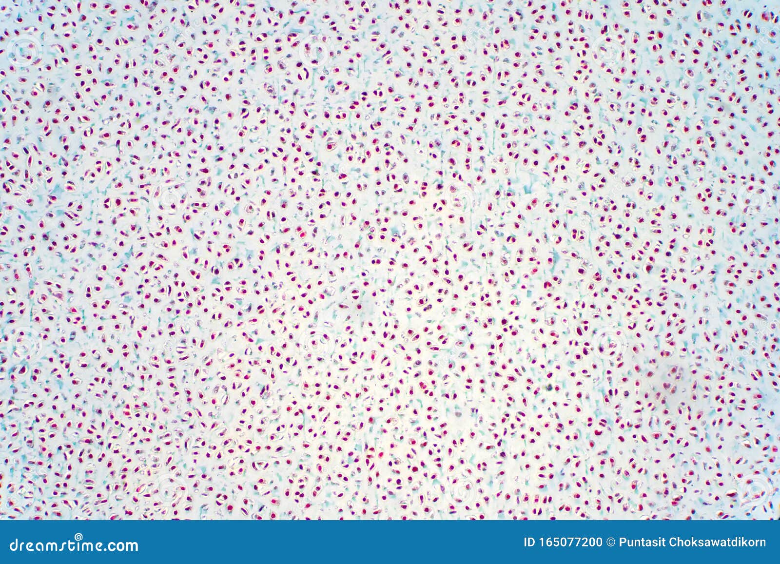 Cartilage is a Resilient and Smooth Elastic Tissue for Pathology ...