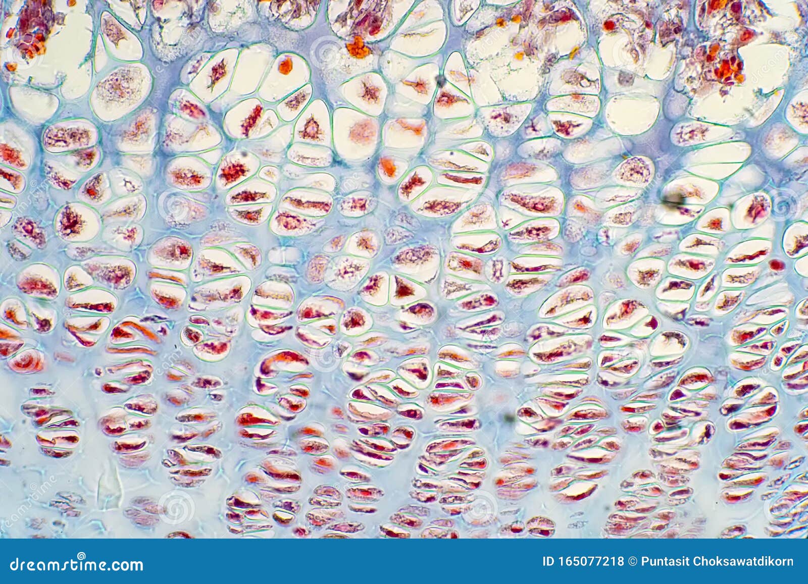 Cartilage is a Resilient and Smooth Elastic Tissue for Pathology ...