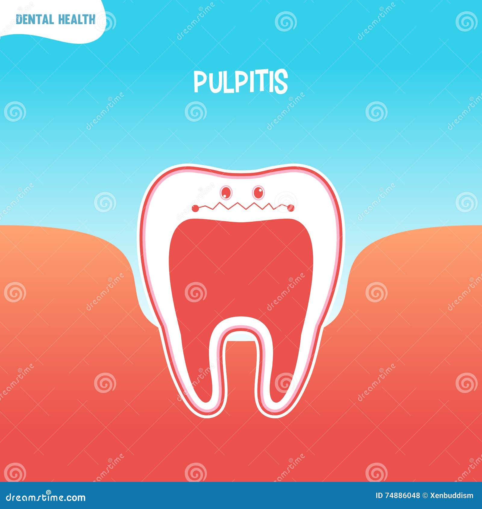 Cartoon Bad Tooth Icon with Pulpitis Stock Illustration - Illustration ...