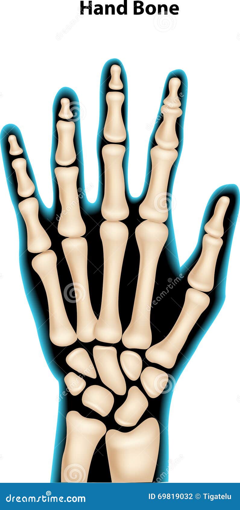Hand Bone Fracture - Distal Radius Fracture And Broken Arm Bone Types ...