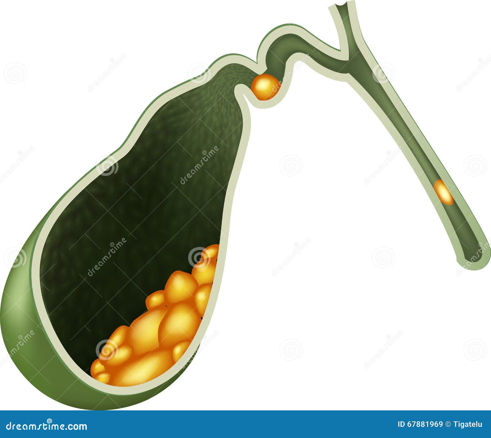Gallbladder Anatomy Poster Vector Illustration | CartoonDealer.com ...