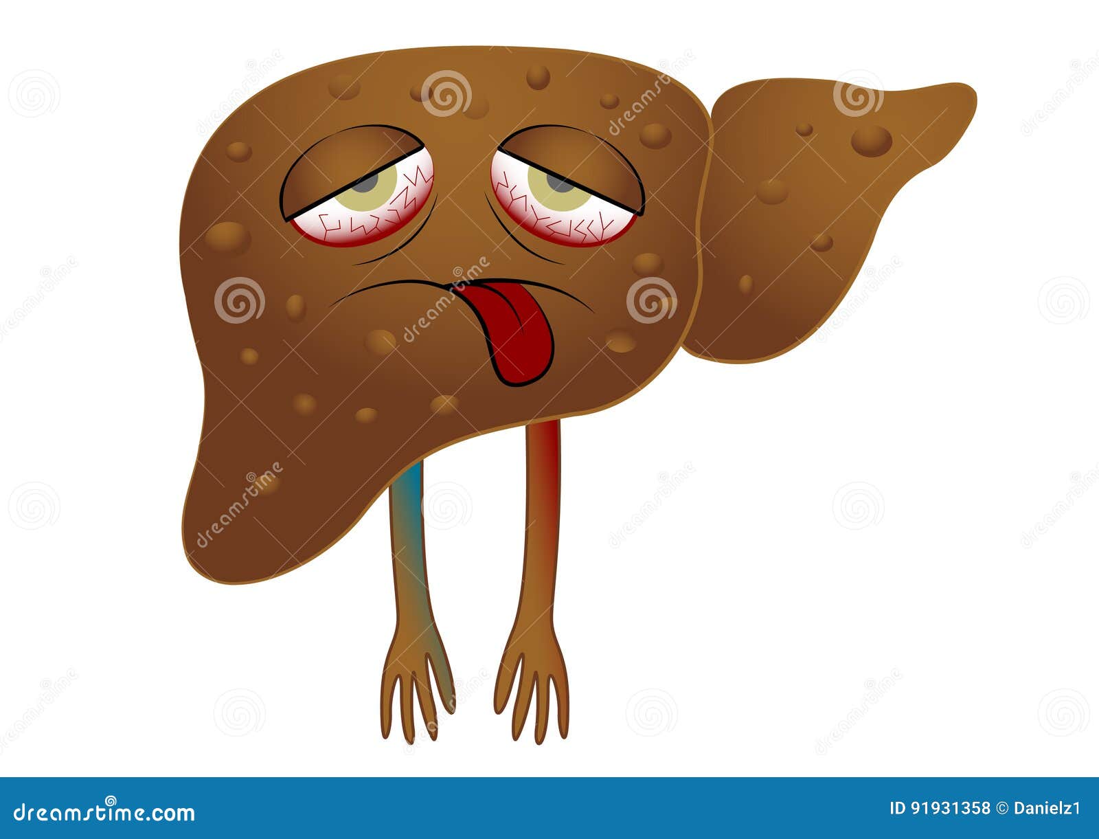 Cartoon Illustration of Sick Liver Stock Vector - Illustration of ...