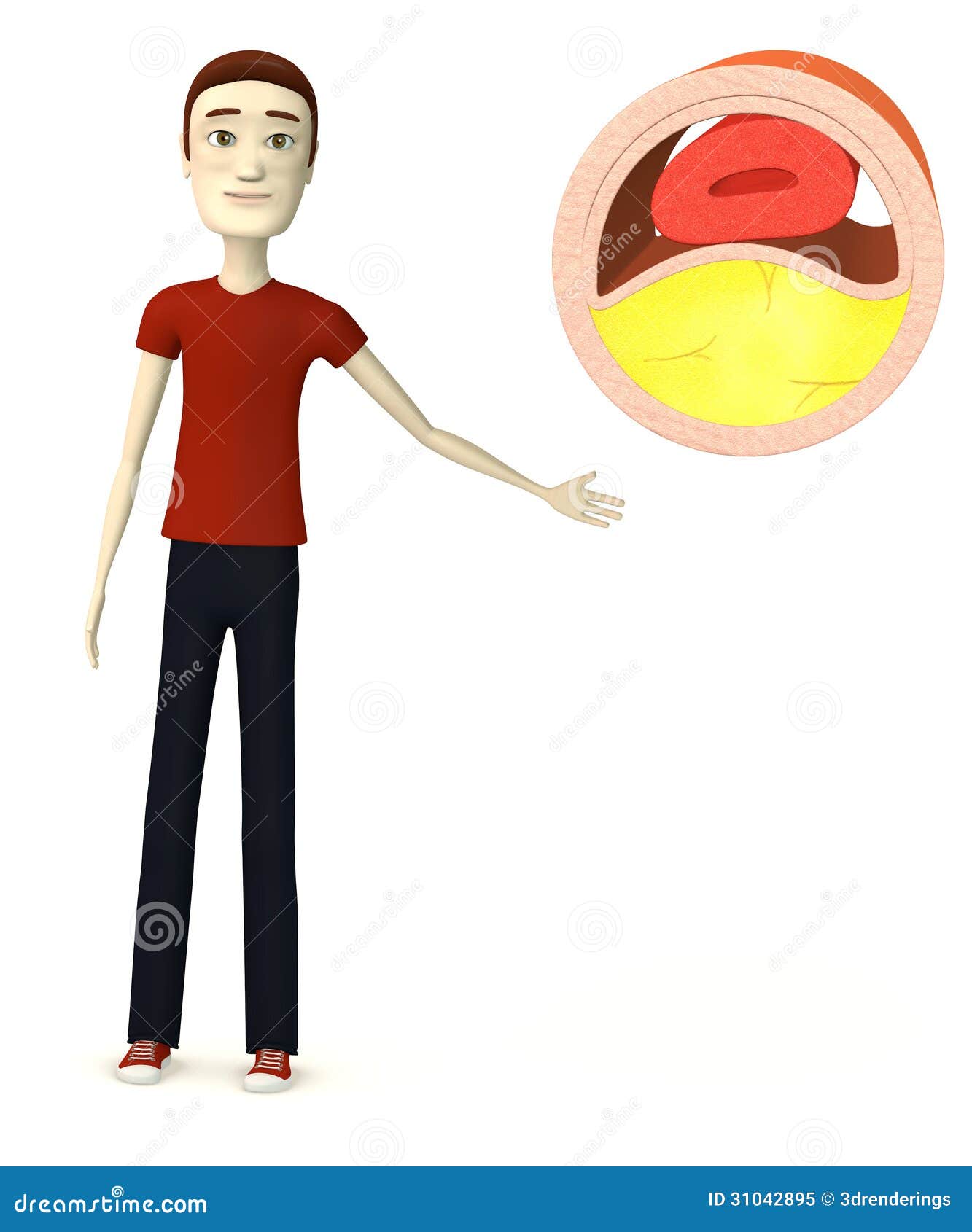 Cartoon Man with Vein with Cholesterol Stock Illustration ...