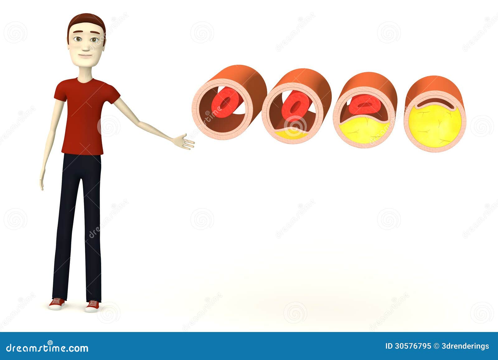 Cartoon Man with Veins with Cholesterol Stock Illustration ...