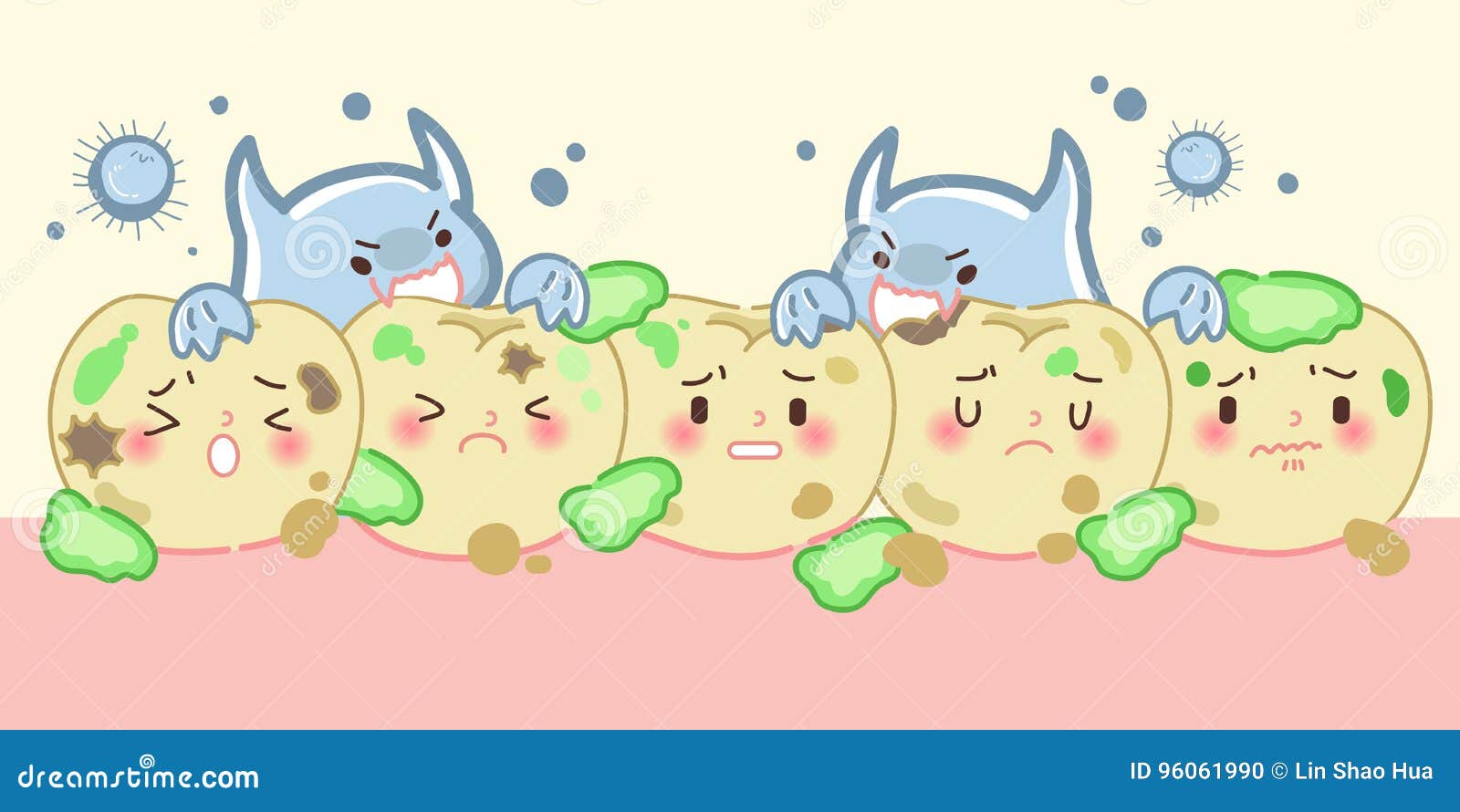 Tooth Decay Anatomy Poster. Enamel And Dentin Caries Vector ...