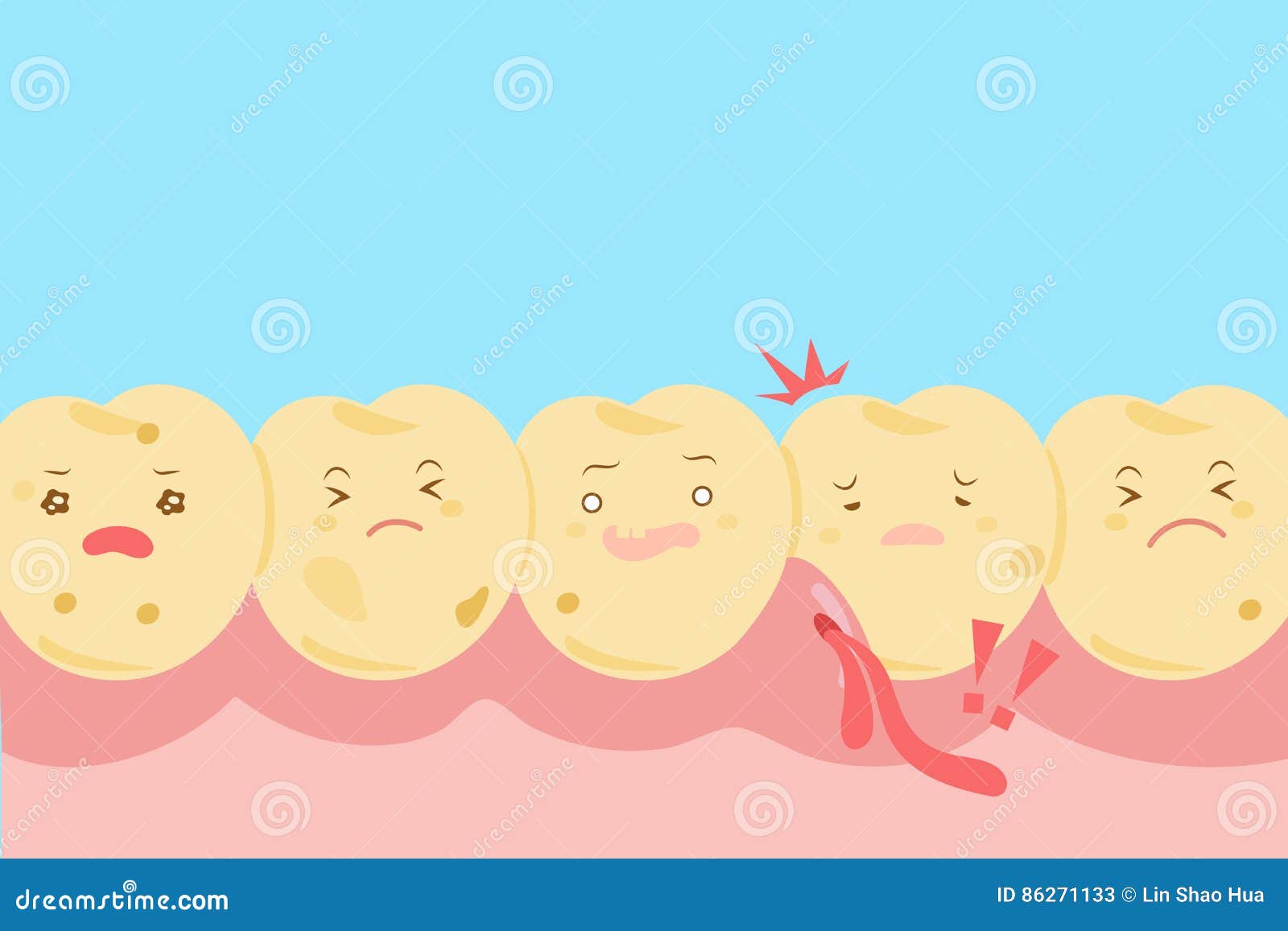 Cartoon Tooth Decay Problem Stock Vector - Illustration of dental ...