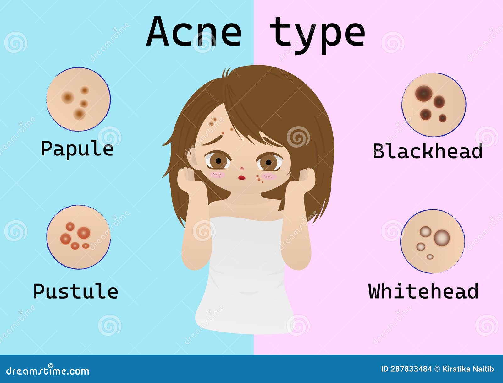 Cartoon Vector about Facial Skin Problems, Cartoon Beaatiful Stock ...