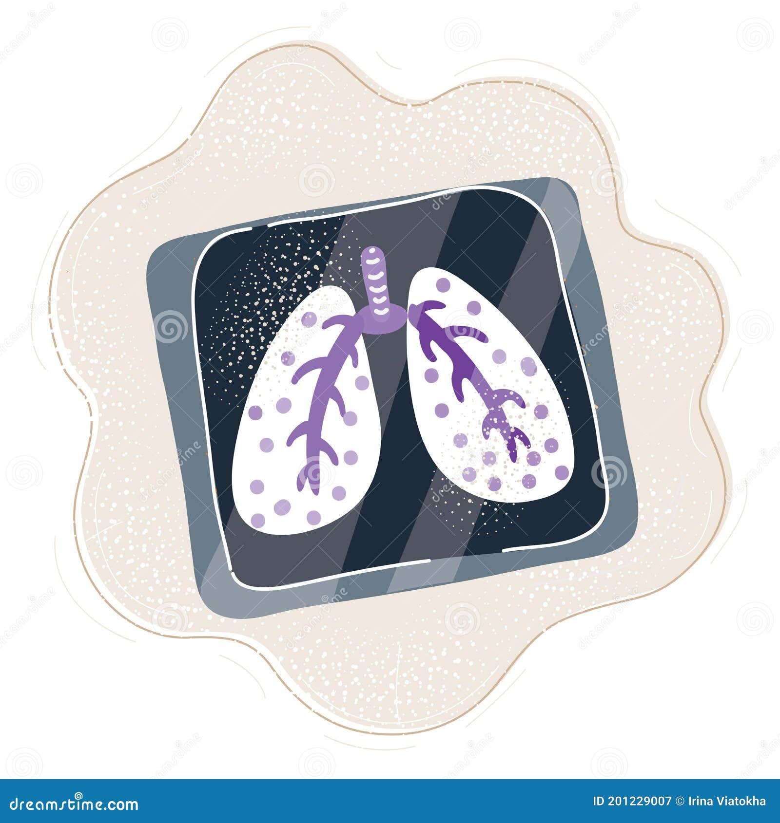 Vector Illustration of X-ray of Chest. Stock Vector - Illustration of ...
