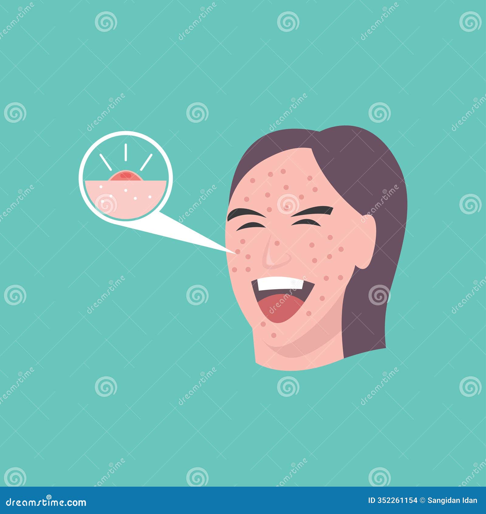 Zoom In Facial To Looking Dry Skin Cartoon Vector | CartoonDealer.com ...