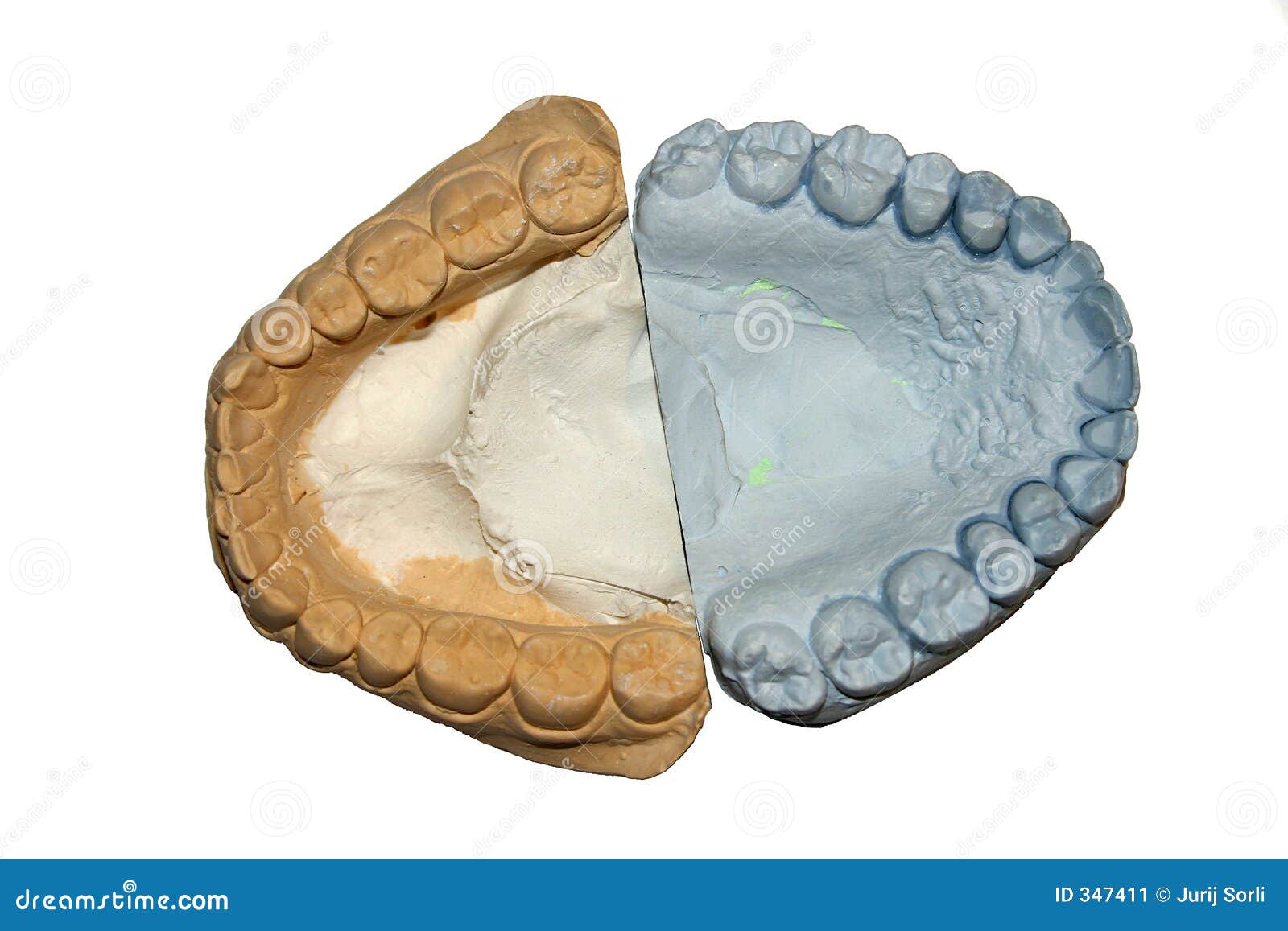 Cast Teeth Model Picture. Image: 347411