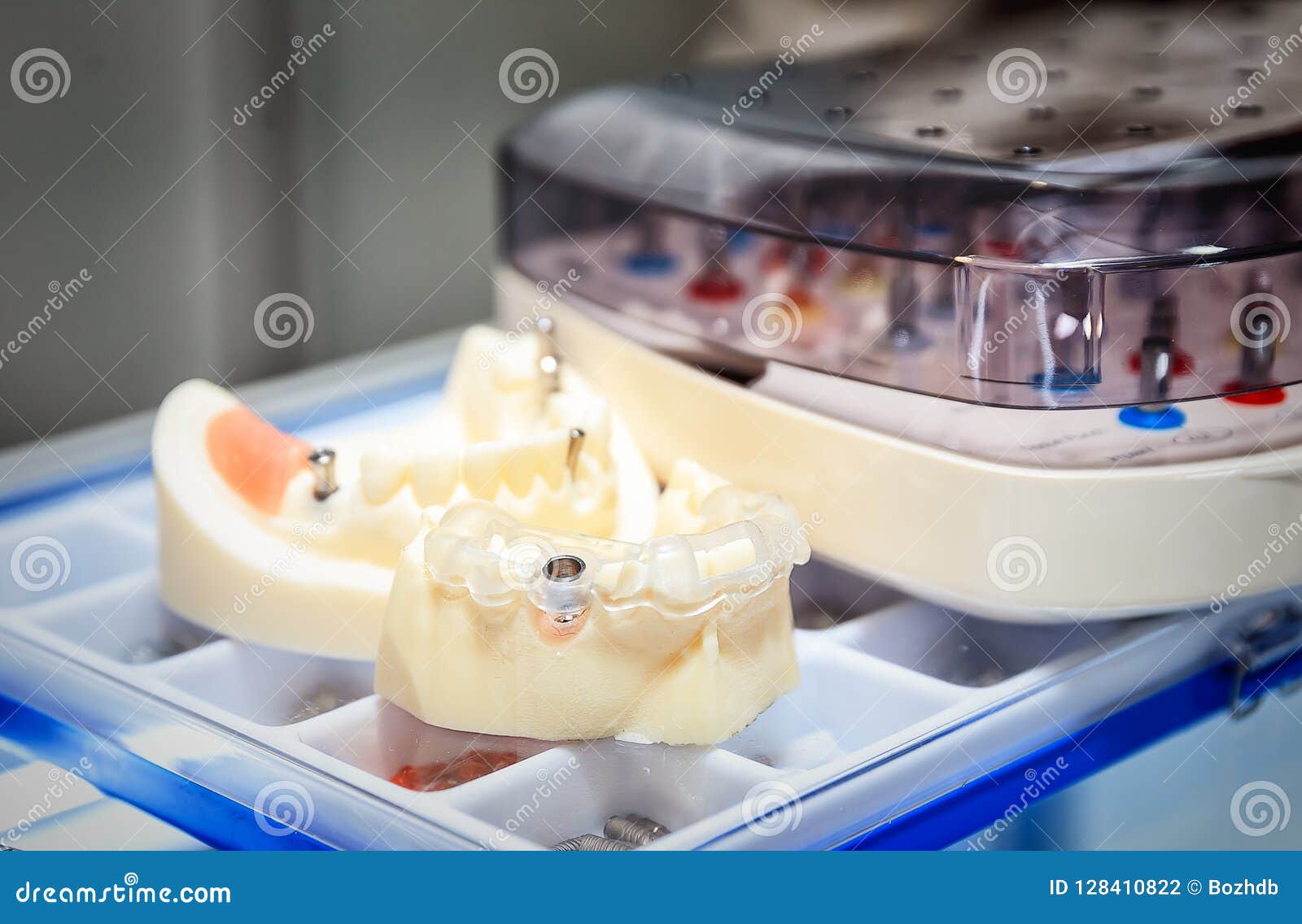 Casts of dentures. stock photo. Image of molar, detail - 128410822