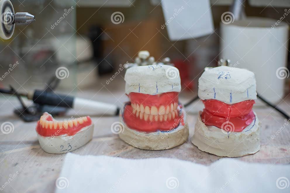 Casts of Human Teeth for Implants. Ceramic Jaw. Workshop for Dental ...