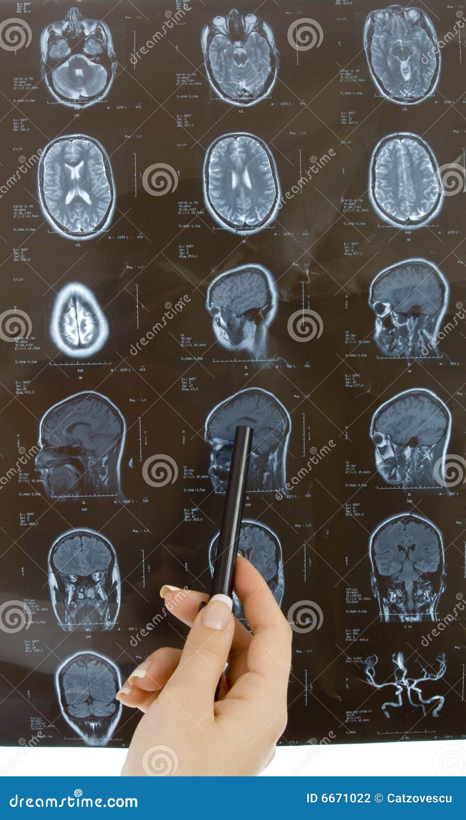 Cat scan stock photo. Image of work, scan, injury, diagnostic - 6671022