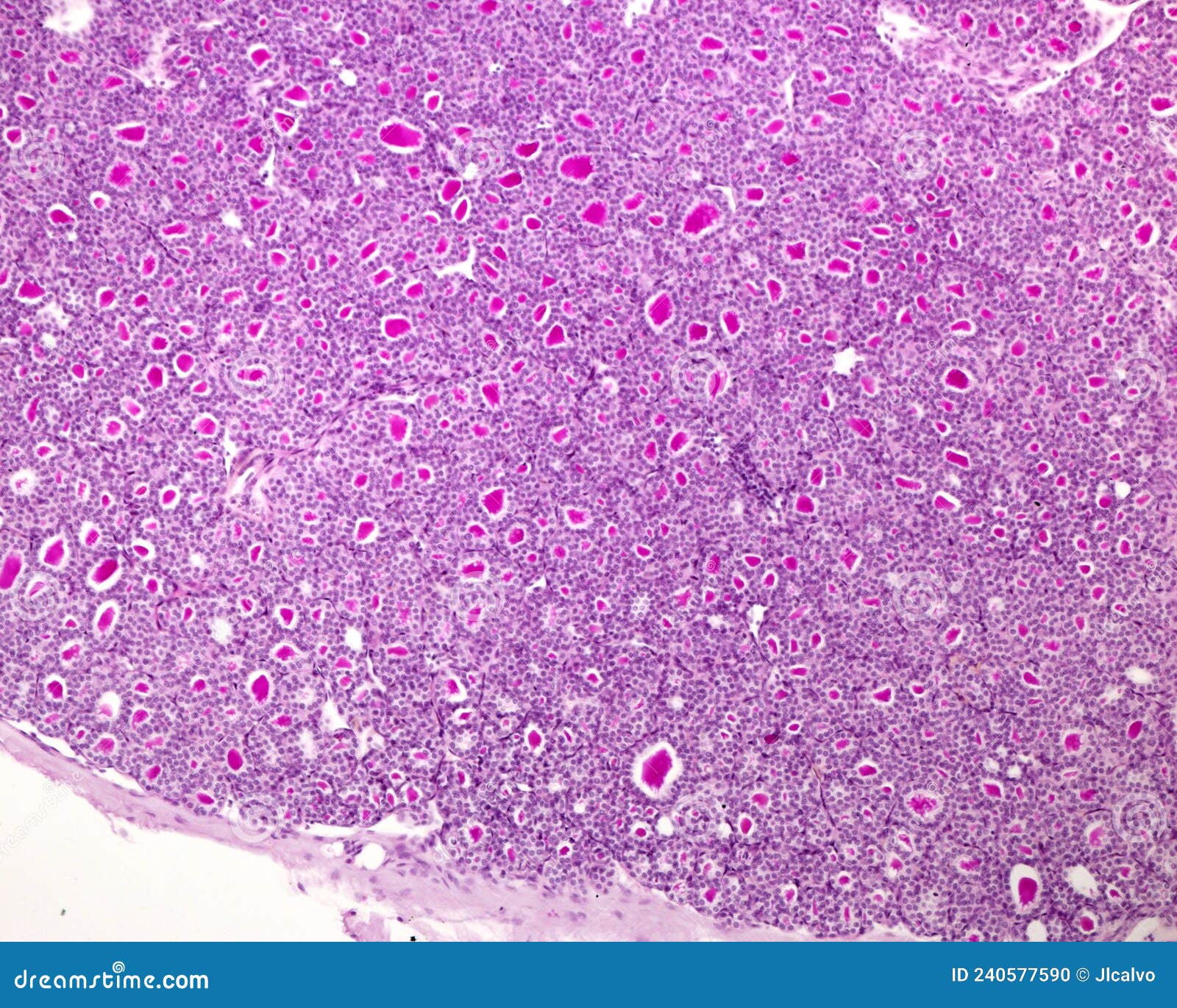 Cat Thyroid Gland. Periodic Acid–Schiff PAS Method Stock Photo - Image ...