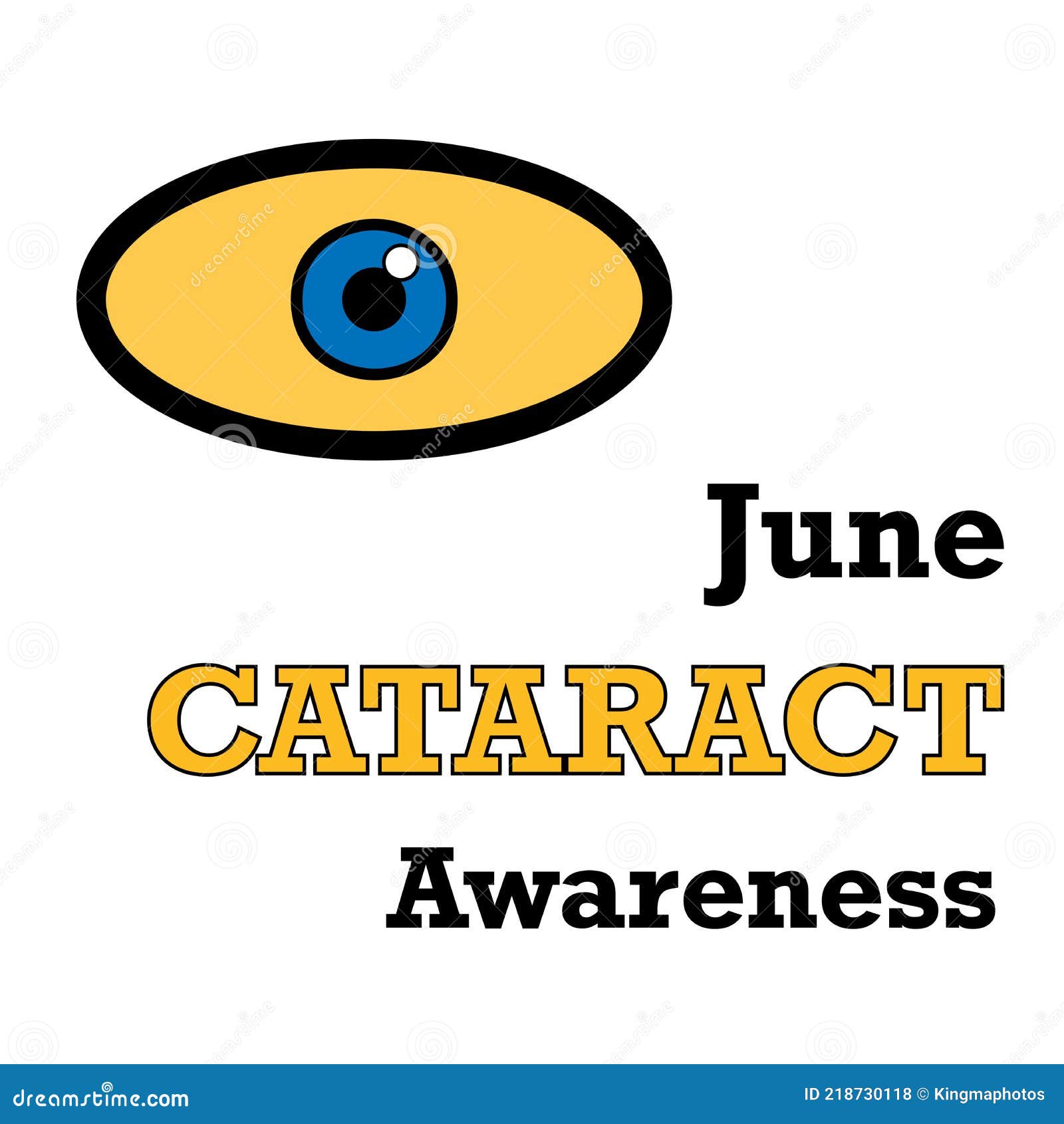 Cataract Disease Poster With Blue Eye On Left Royalty-Free Stock Image ...