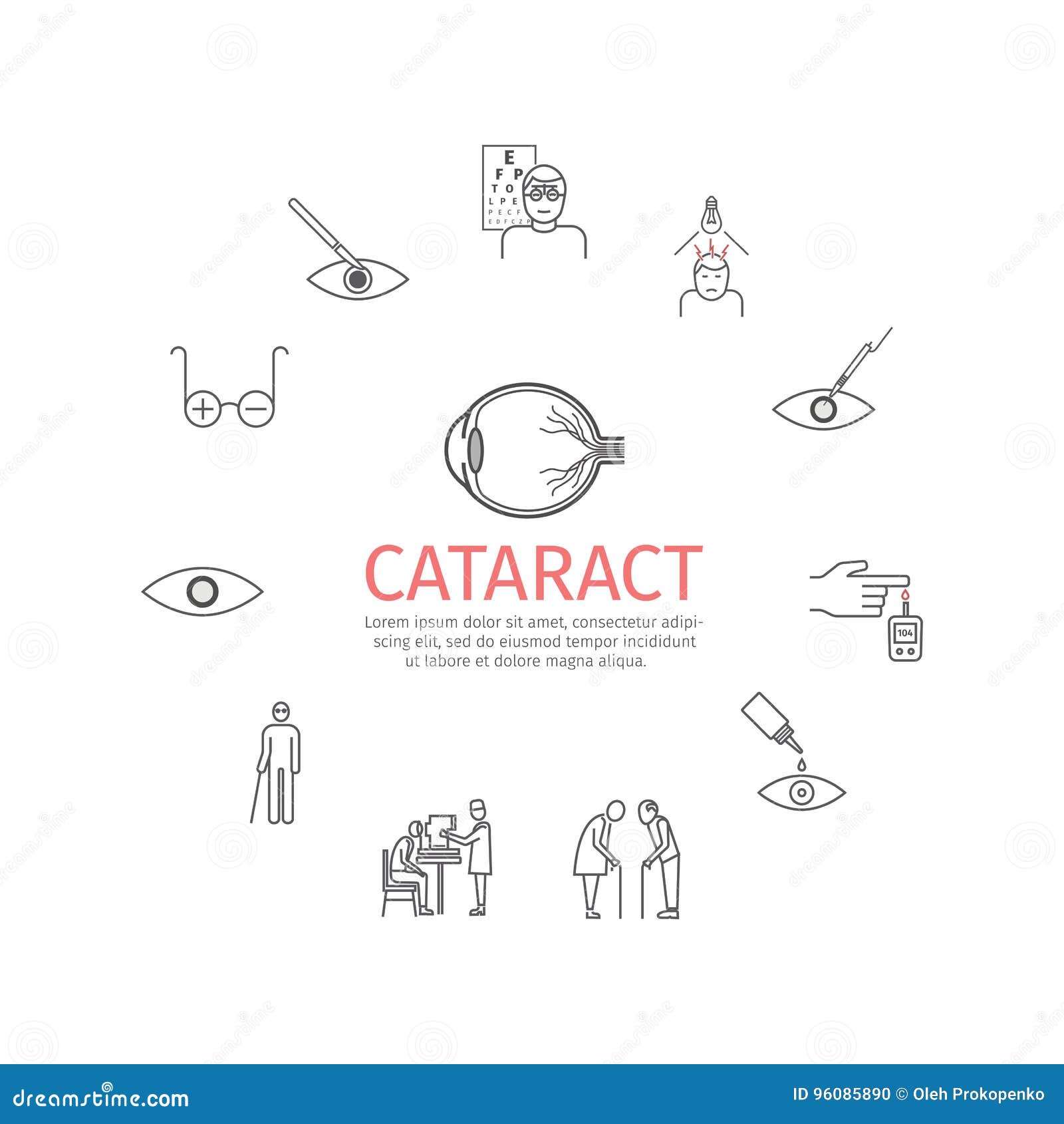Cataract. Symptoms, Treatment. Line Icons Set Stock Illustration ...