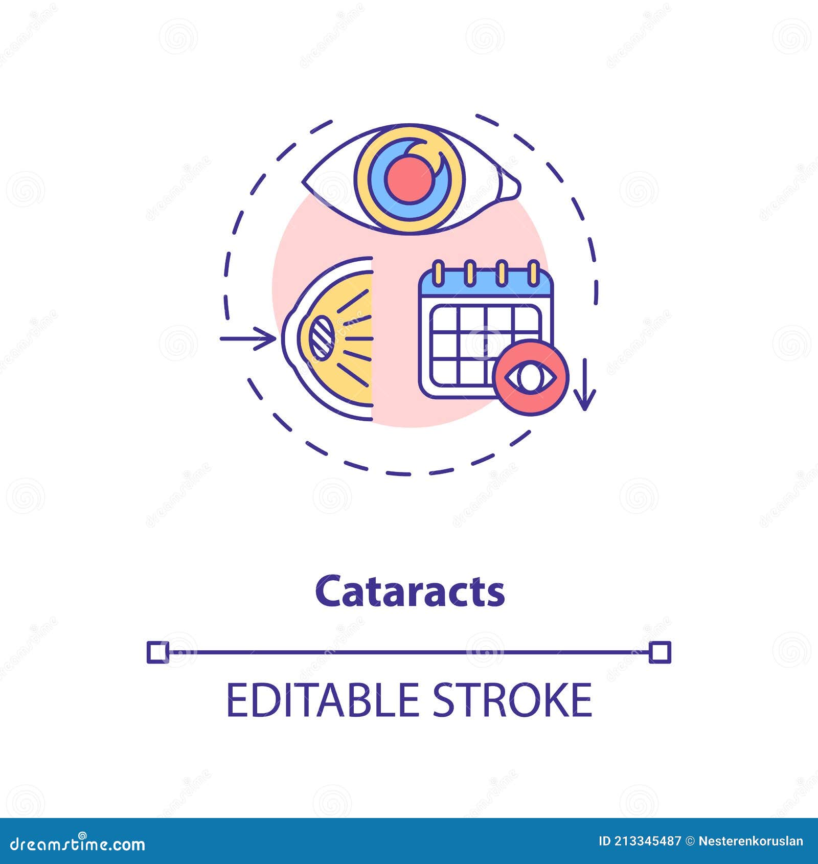 Cataracts Vision Disorder And Normal Eye Vision Anatomy Cartoon Vector ...