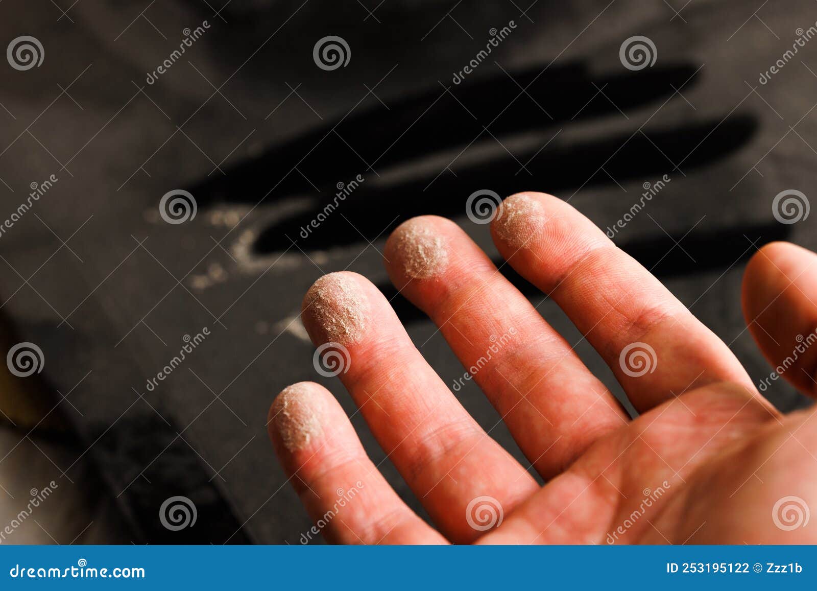 Caucasian Hand with Dust on Finger Tips after Touching Black Dusty ...