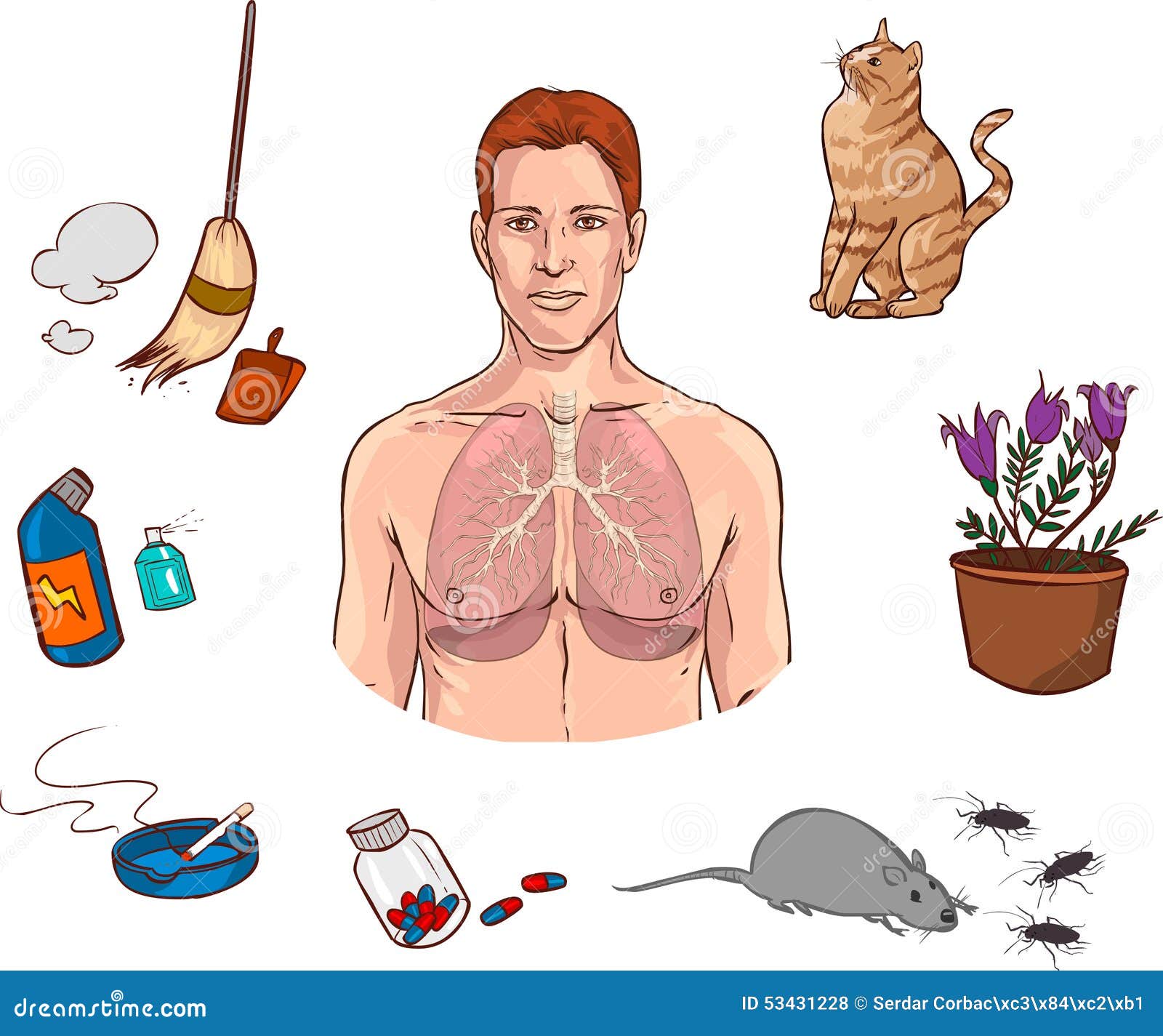 Causes of allergies stock vector. Illustration of disease - 53431228