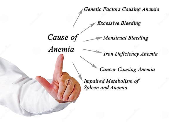 Causes of Anemia stock photo. Image of bleeding, excessive - 84301996