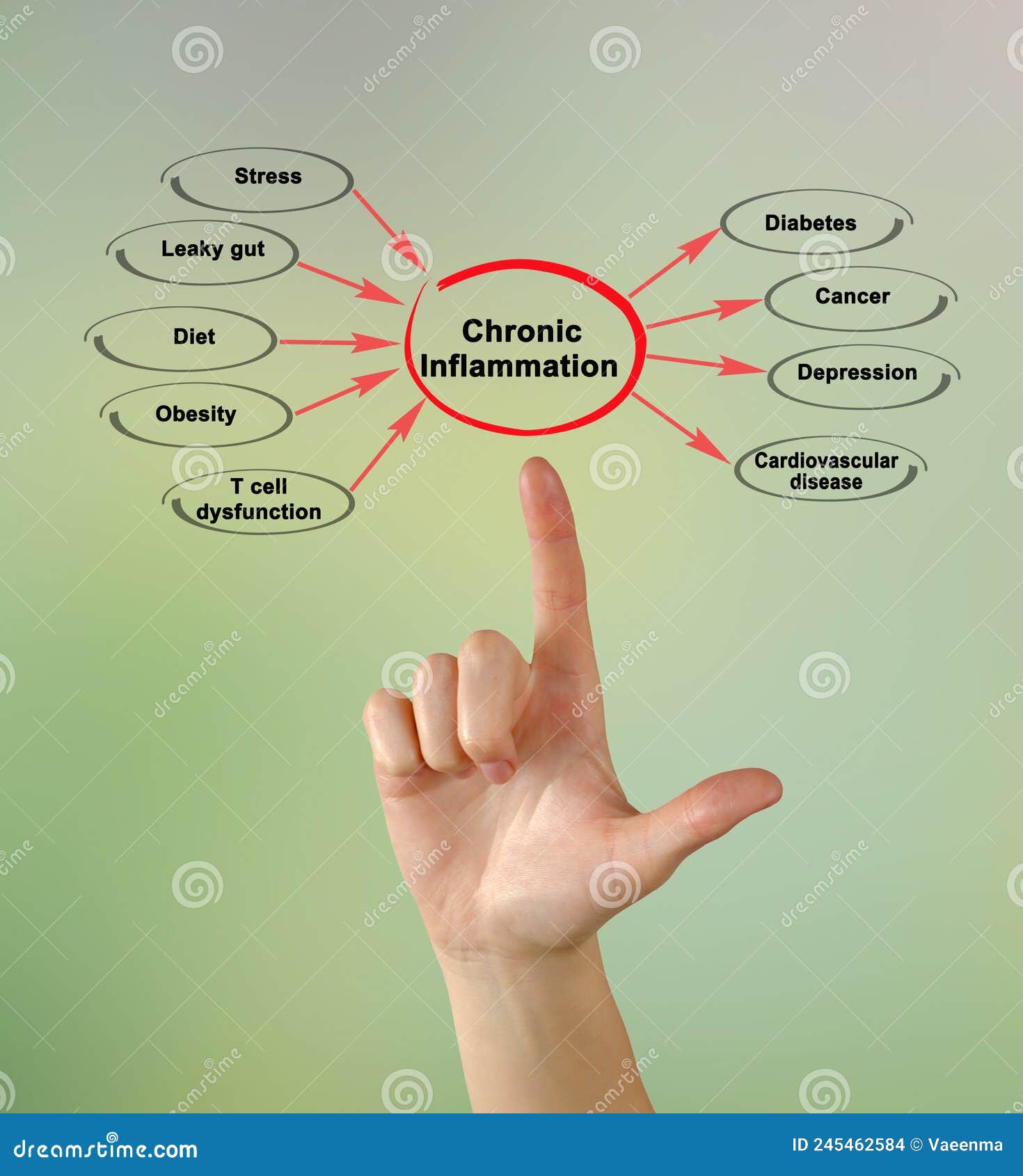 Chronic Inflammation Royalty-Free Stock Photography | CartoonDealer.com ...