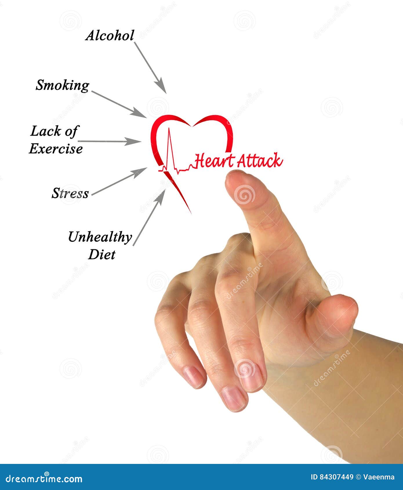 Causes of heart attack stock image. Image of female, lecture - 84307449