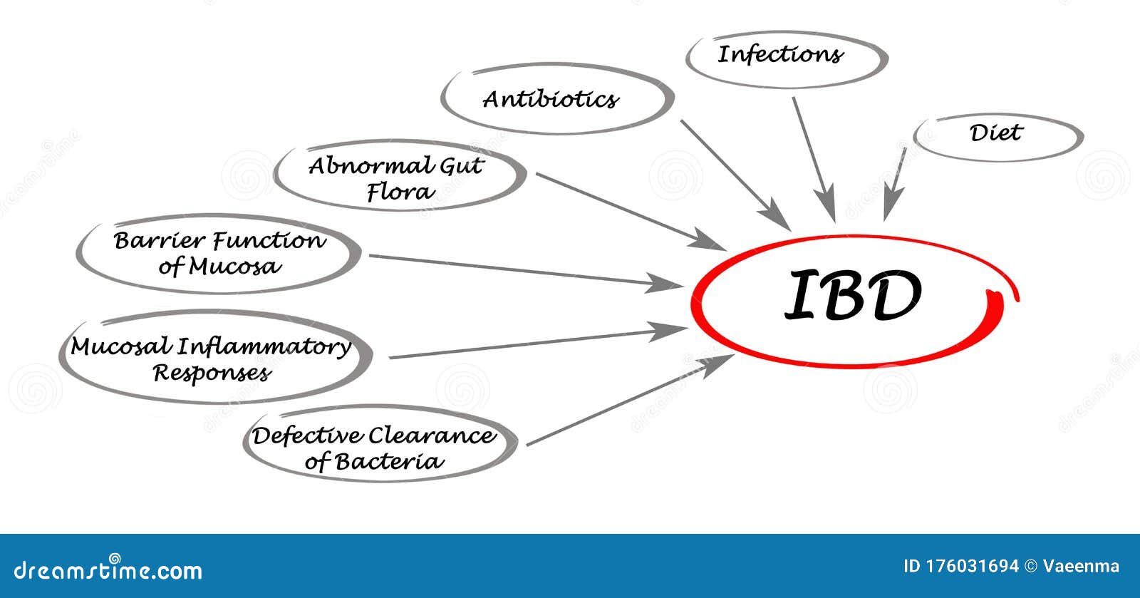 Inflammatory Bowel Disease IBD Is Shown Using The Text Stock ...