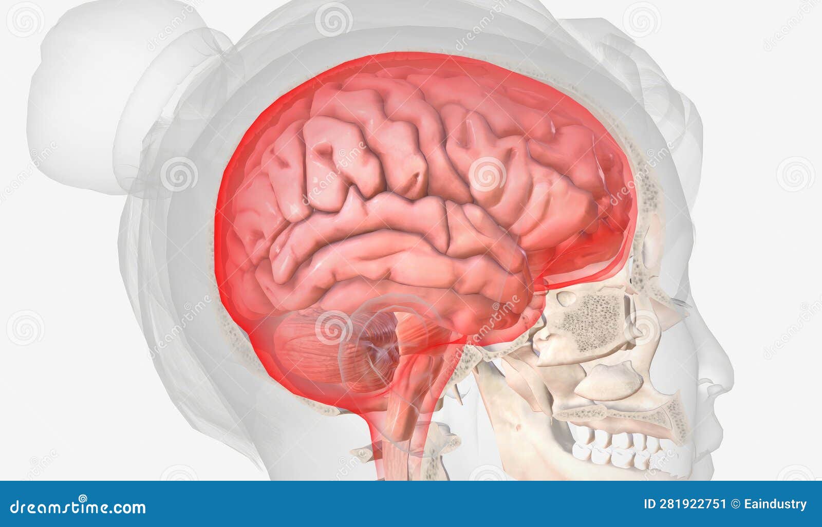 The Causes of Intracranial Pressure Stock Illustration - Illustration ...