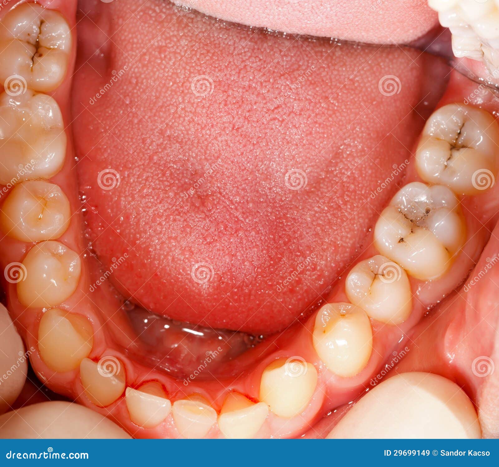 Old Rare Two-cavity Mold For Cast Lead Bullets Stock Photo ...