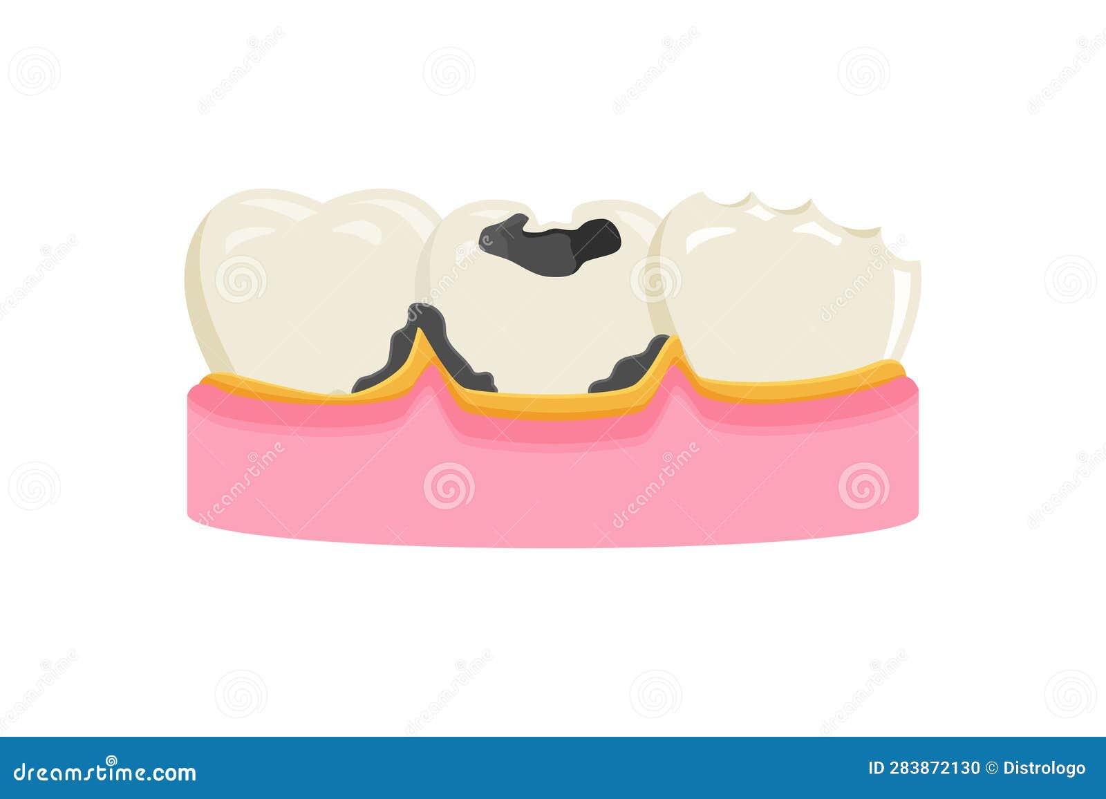 Cavity, Toothache, Swollen Tooth, Woman, Simple Illustration Cartoon ...