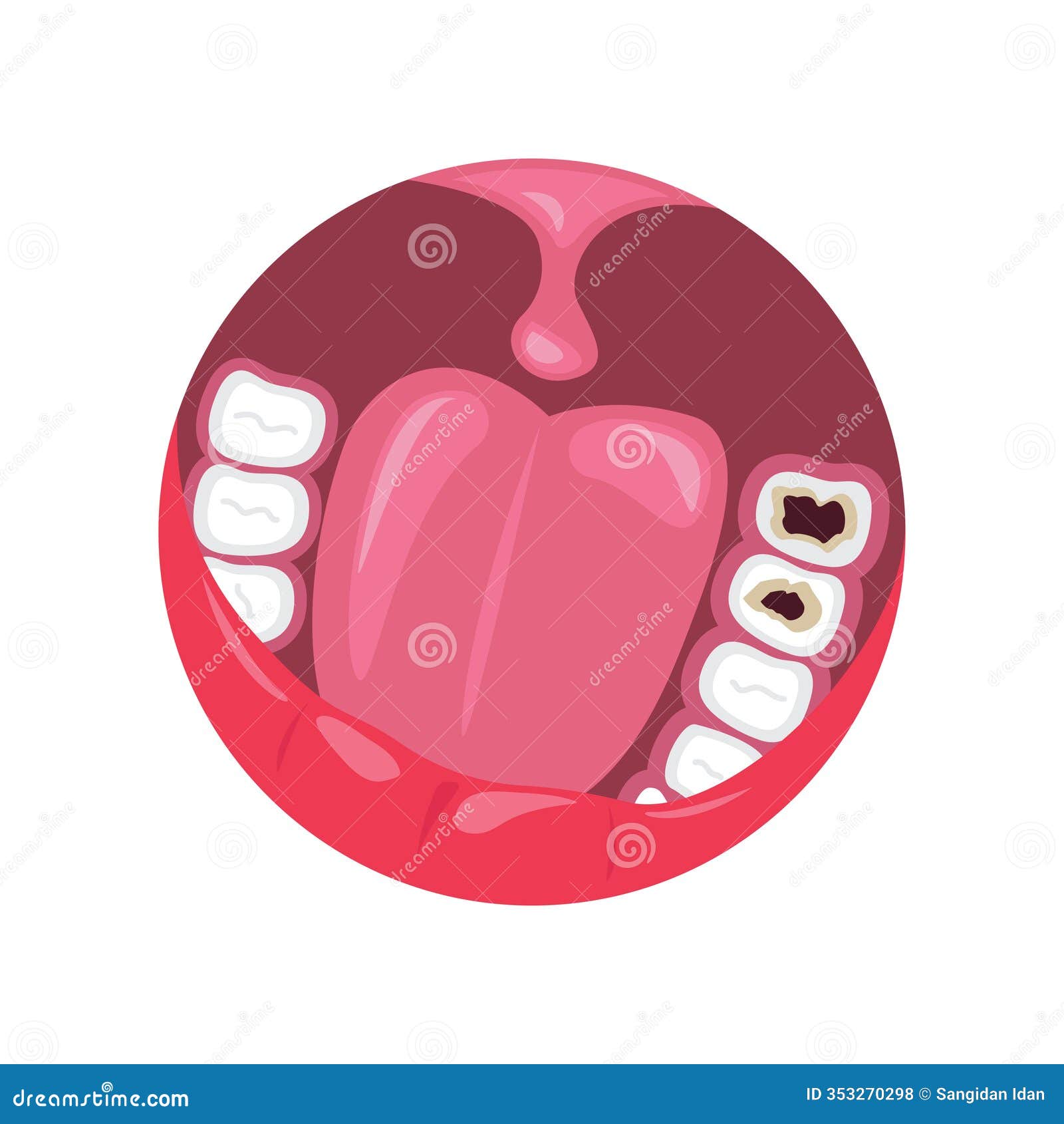 Cavity in the Tooth Cartoon Vector Element Design Template Stock ...