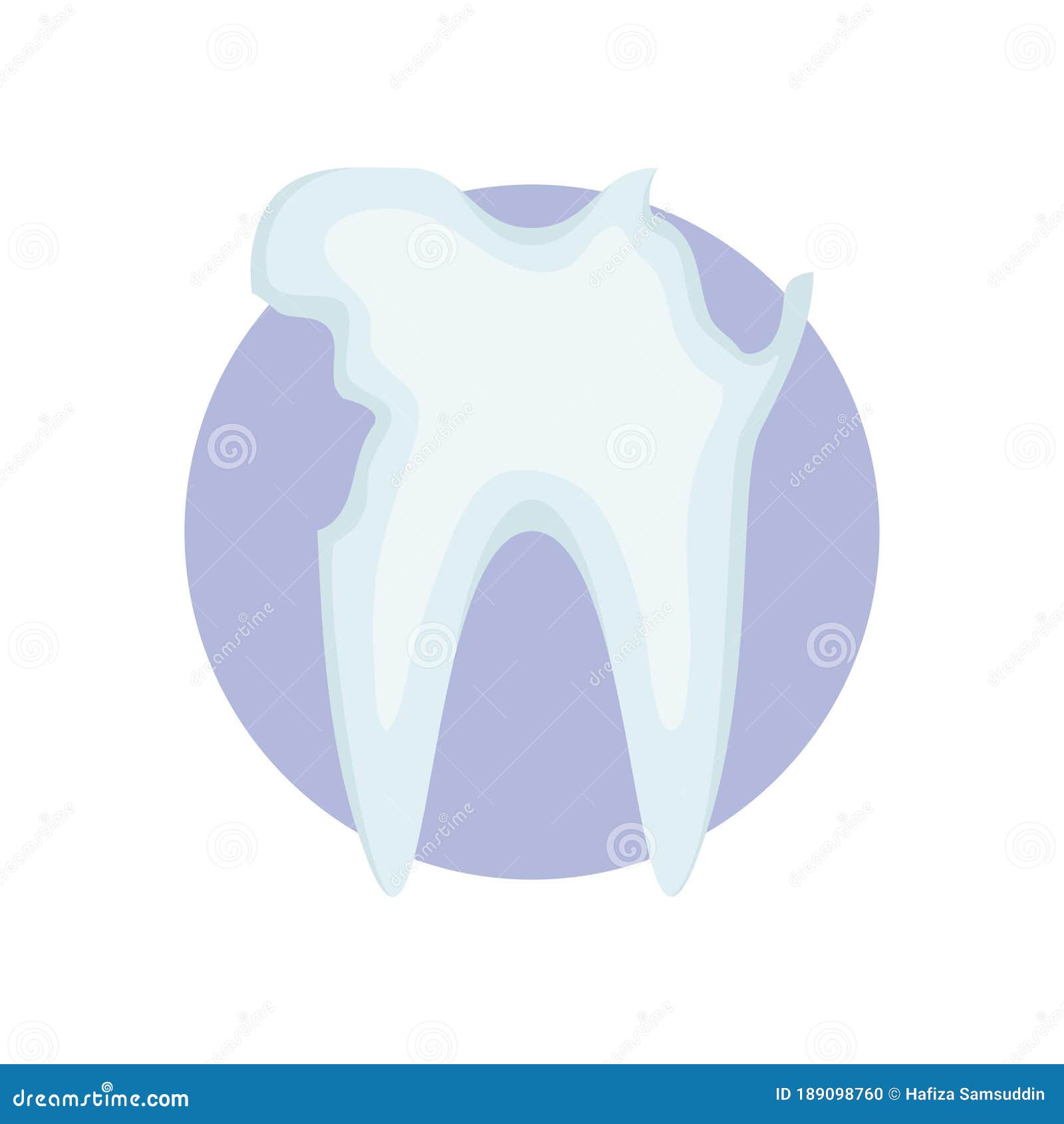 Cavity in Tooth. Vector Illustration Decorative Design Stock Vector ...